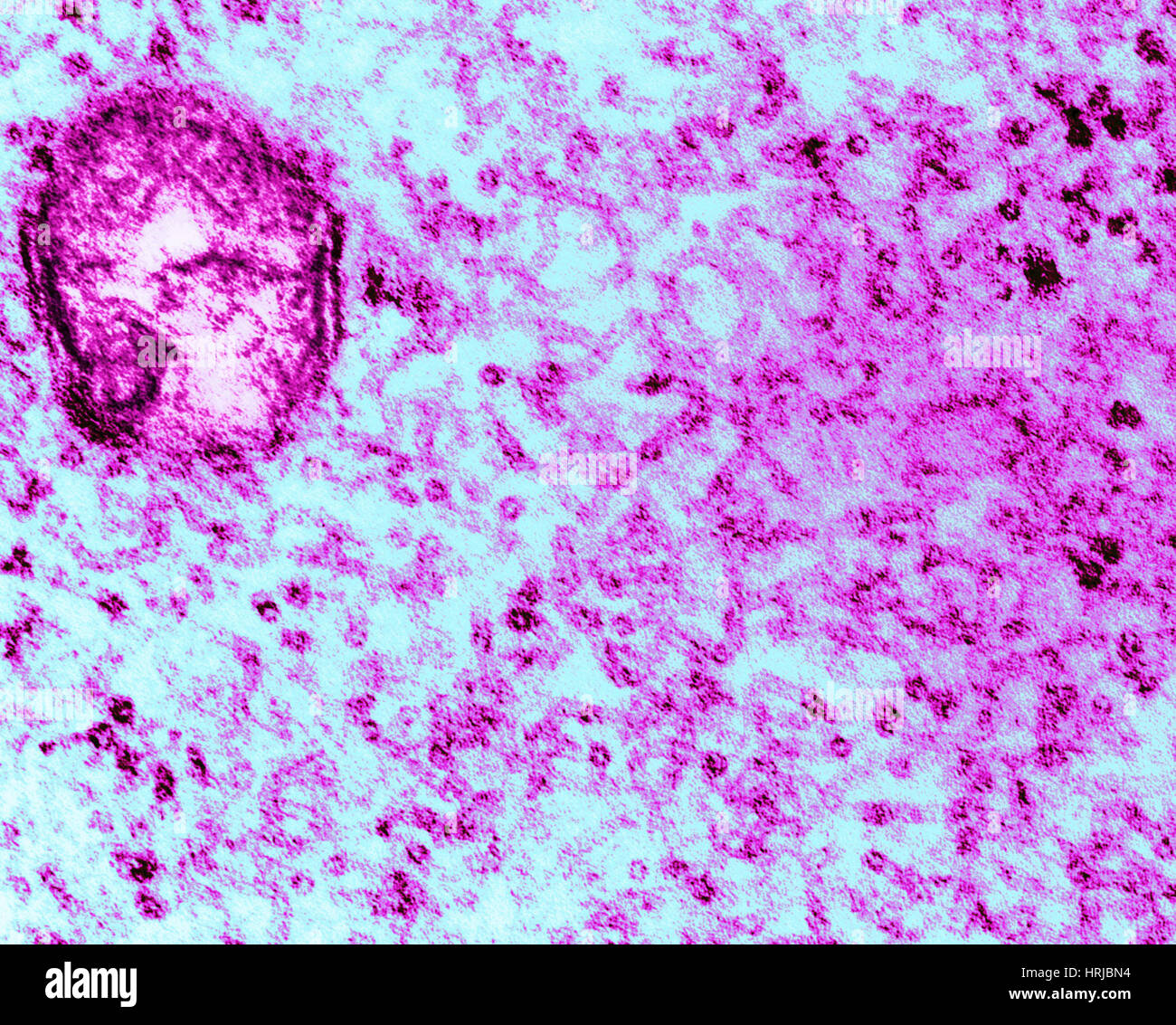 Mumps Virus, TEM Stock Photo - Alamy