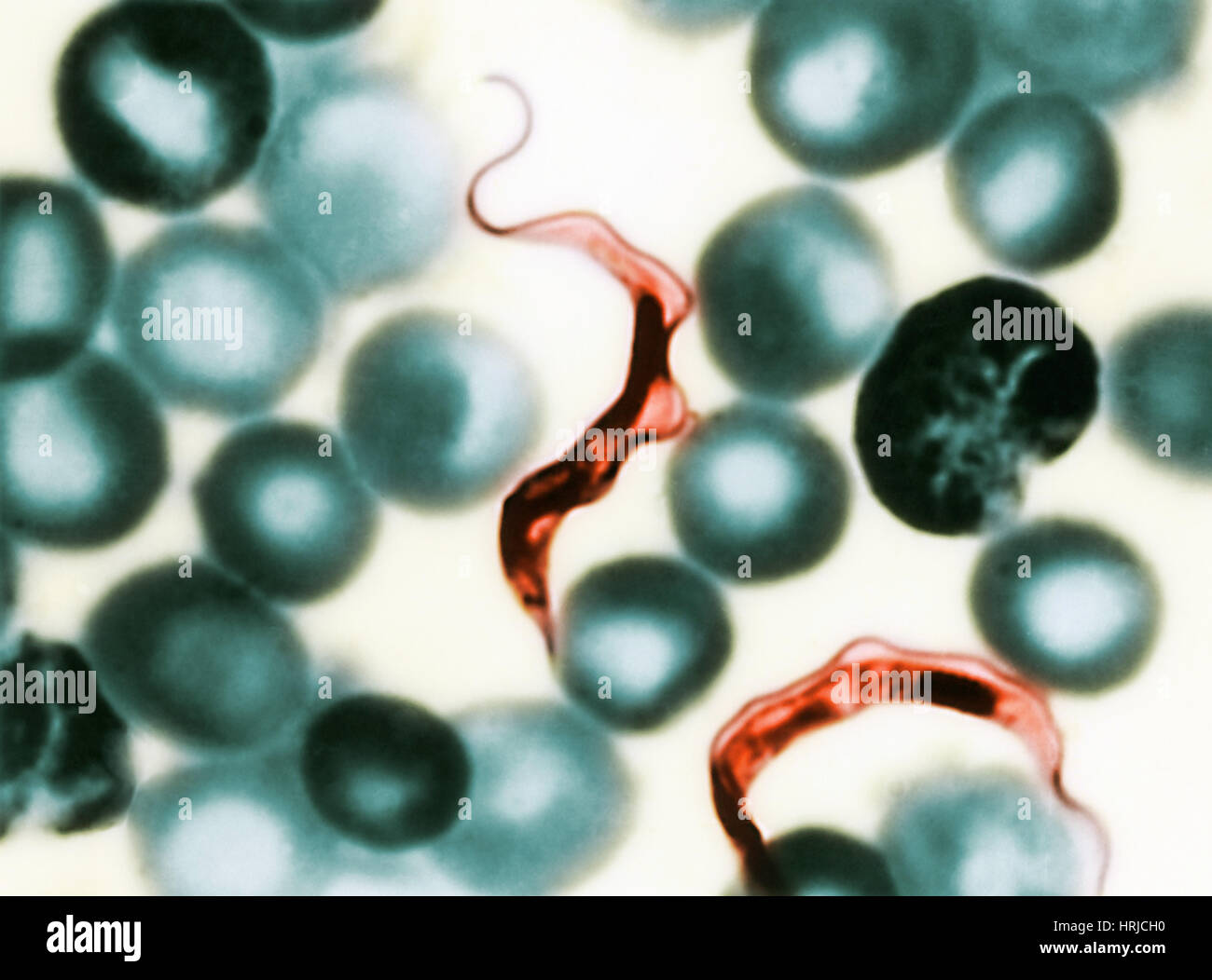 Trypanosoma Lewisi