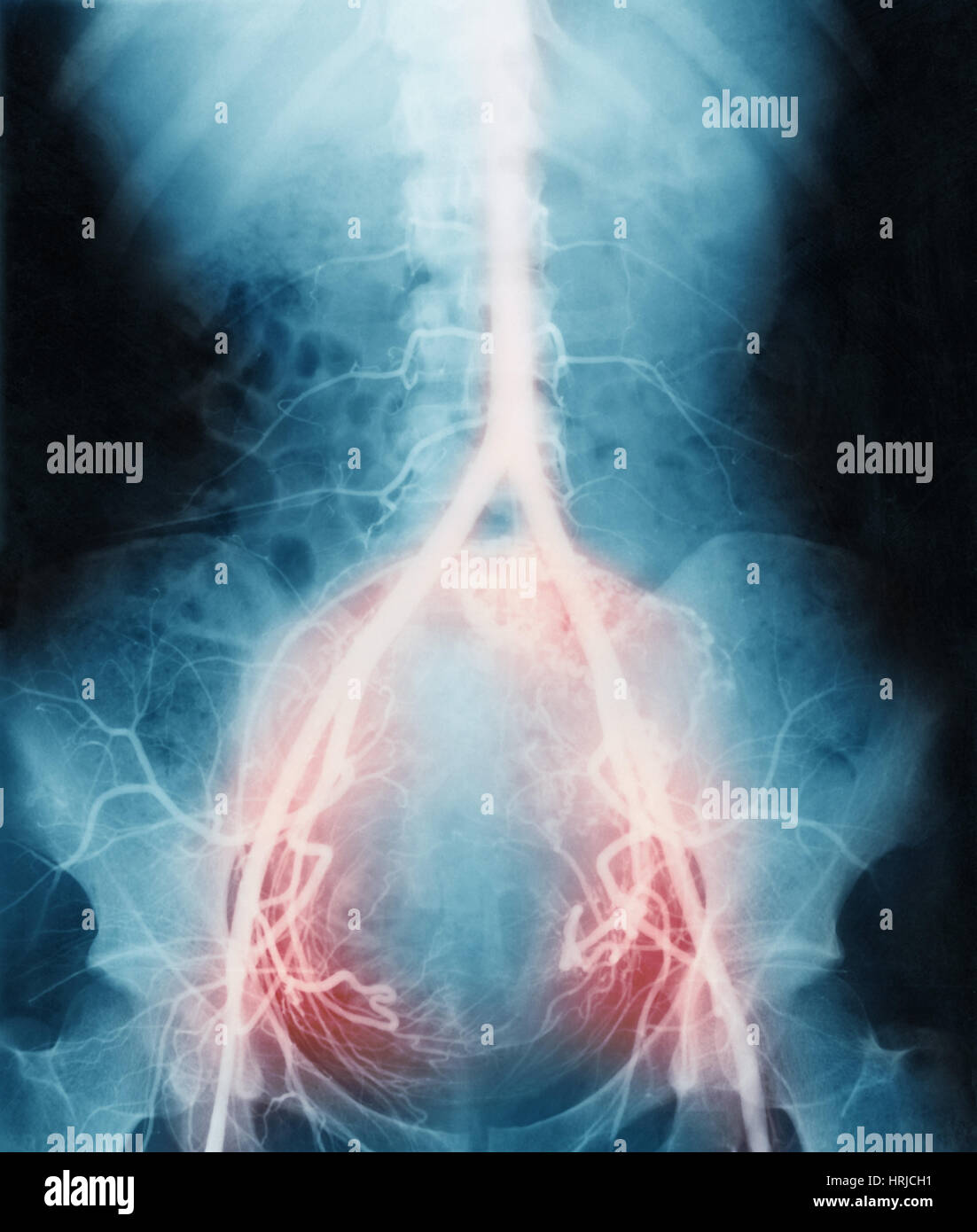 Placenta position hi-res stock photography and images - Alamy