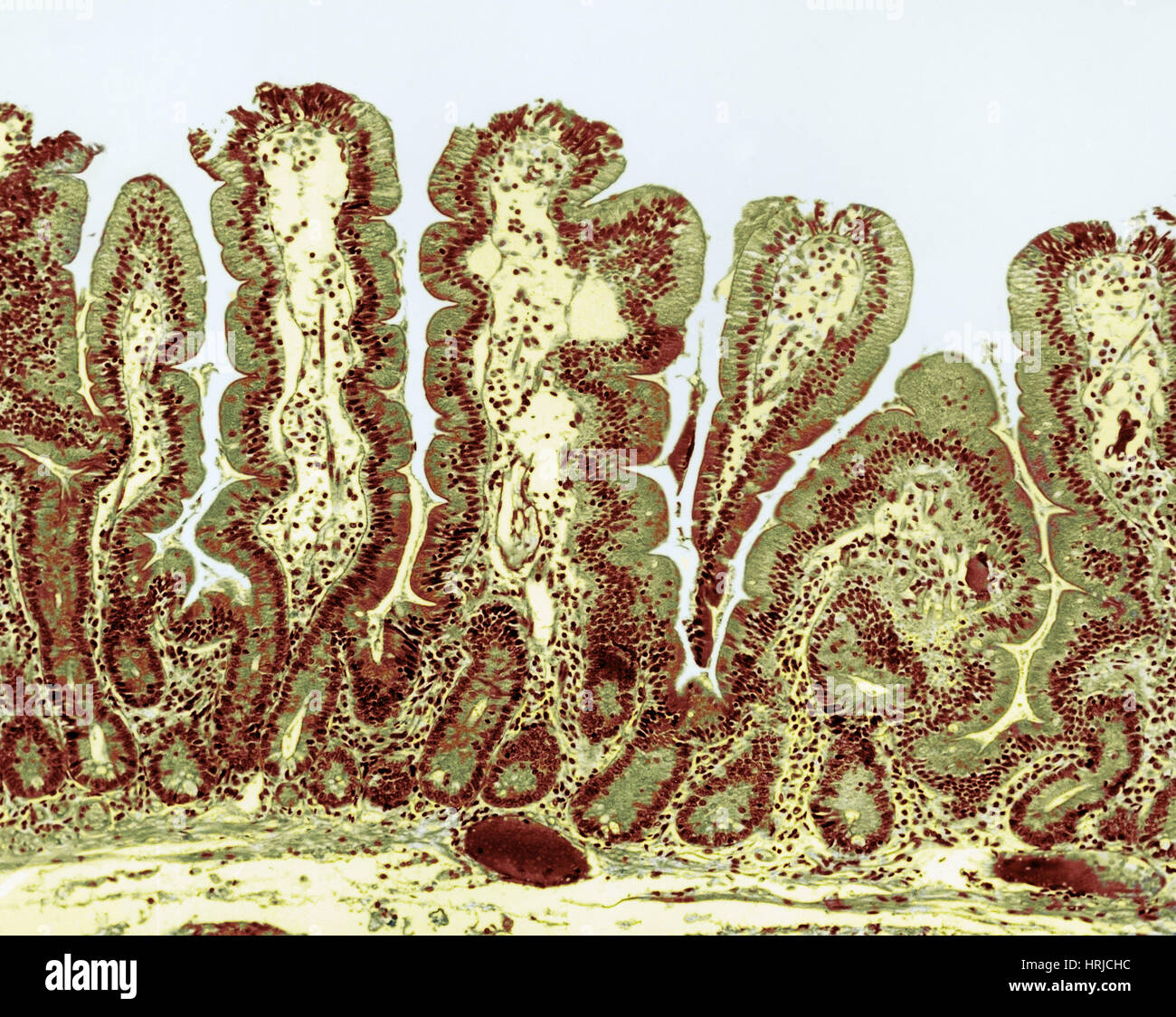 Giardia micrograph hi-res stock photography and images - Alamy