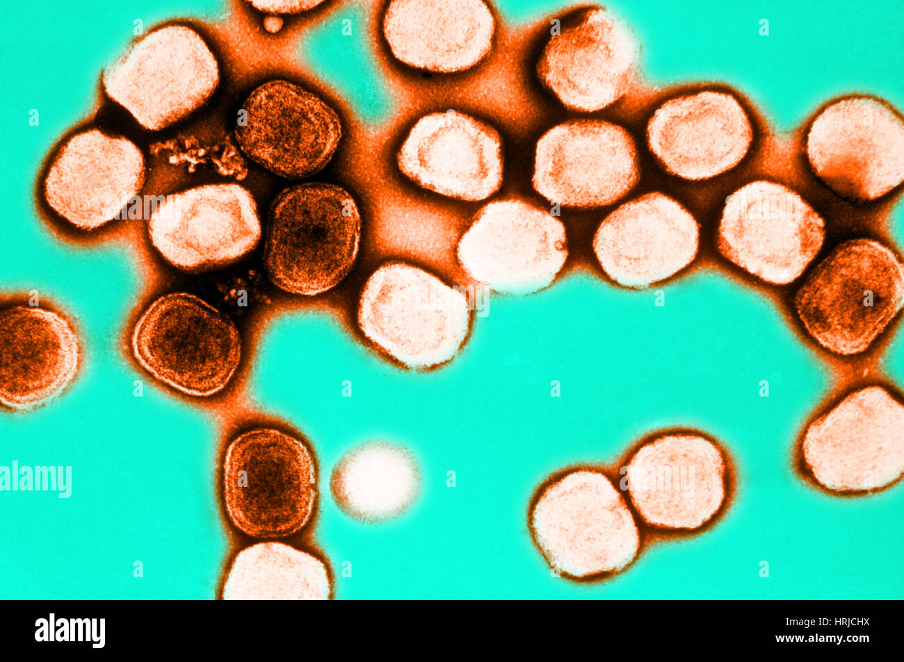 Vaccinia Virus, Eradicated Smallpox, TEM Stock Photo - Alamy