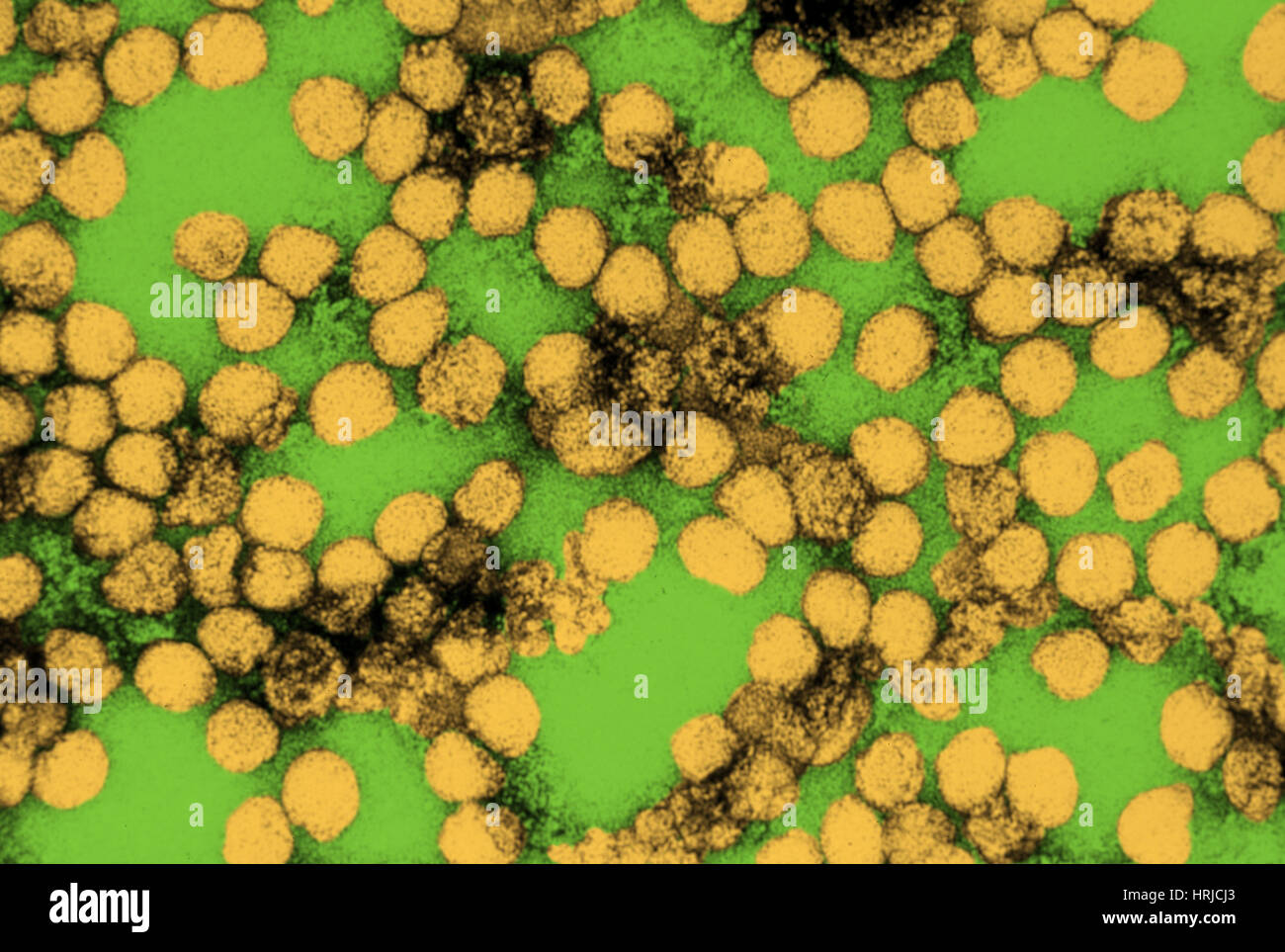 Yellow Fever Virus, TEM Stock Photo - Alamy