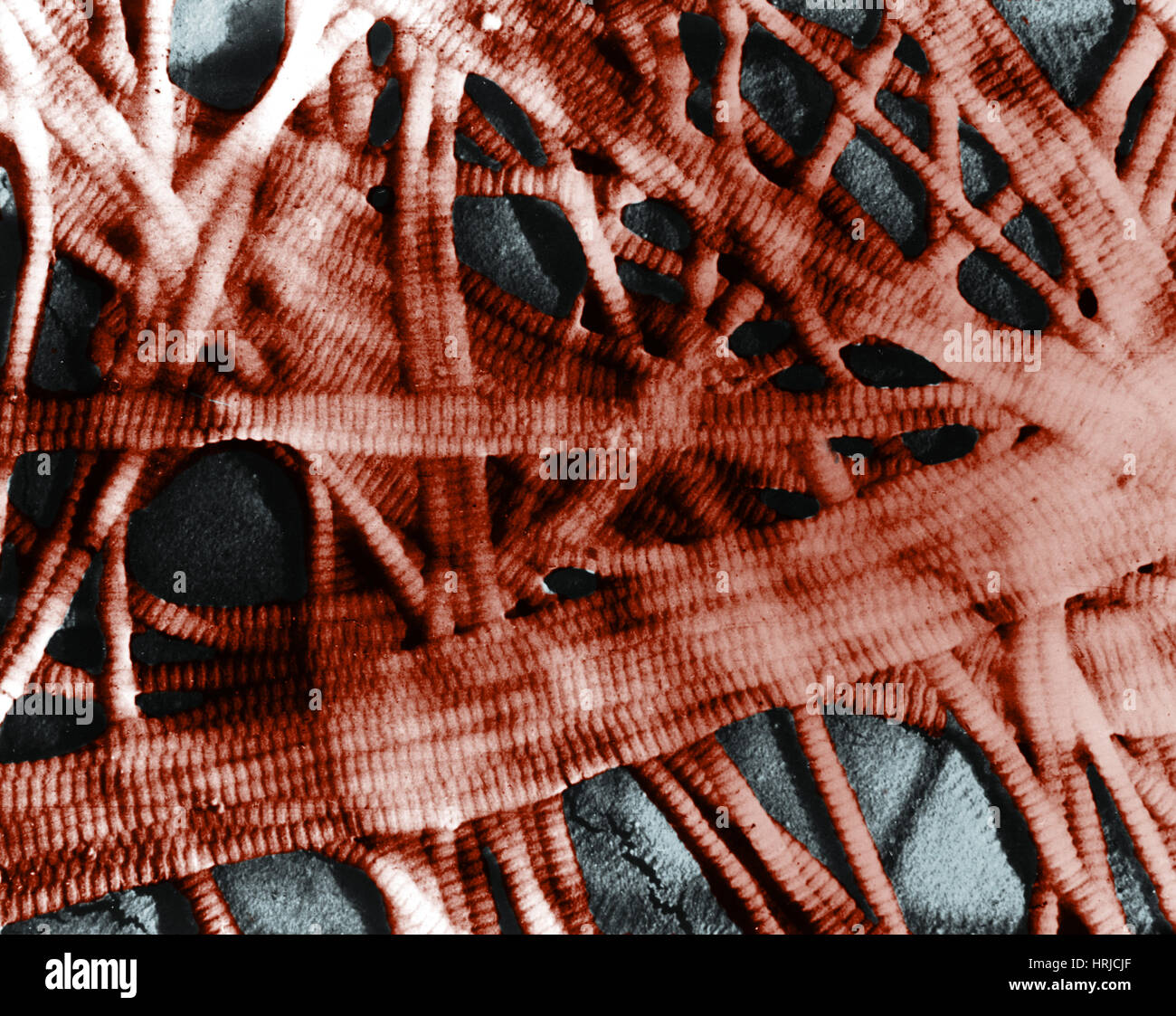 Connective tissue micrograph hi-res stock photography and images - Alamy