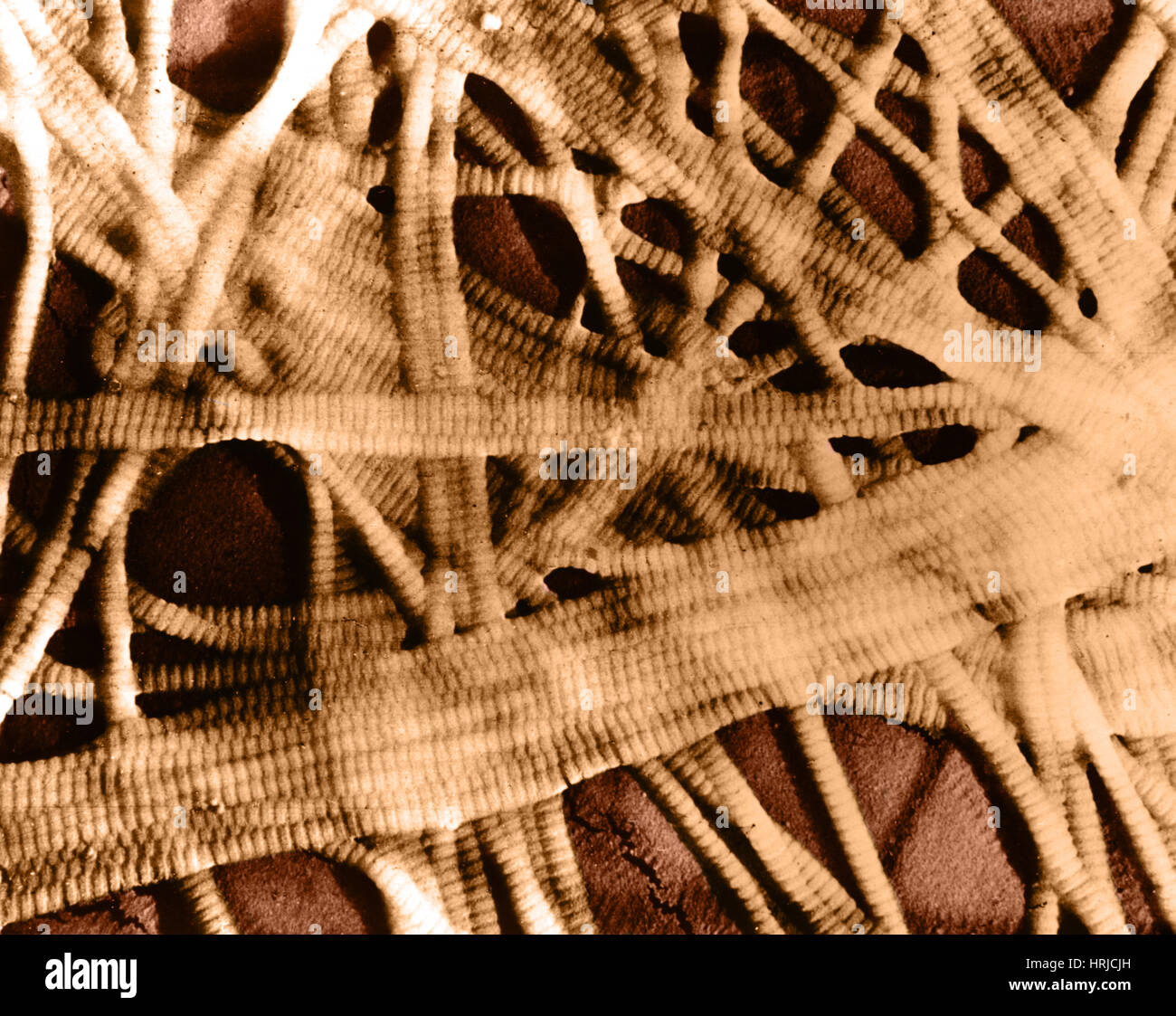 Subcutaneous Connective Tissue, SEM Stock Photo - Alamy