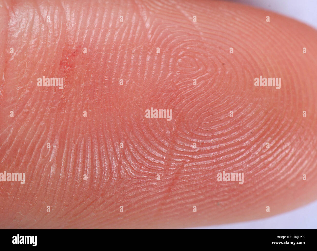 Fingertip showing Fingerprint Ridges Stock Photo - Alamy