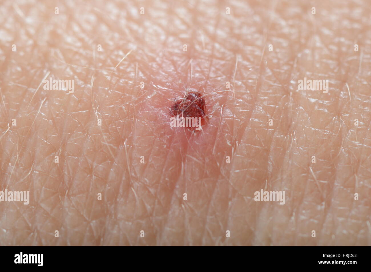 Scab Stock Photo Alamy Scab Stock Photo Alamy