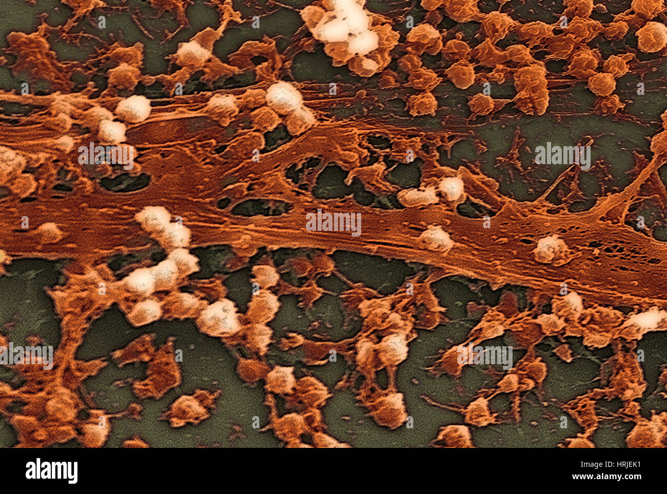 Staphylococcus aureus skin hi-res stock photography and images - Alamy