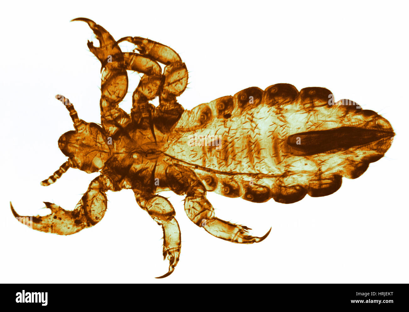 Human Louse, LM Stock Photo - Alamy