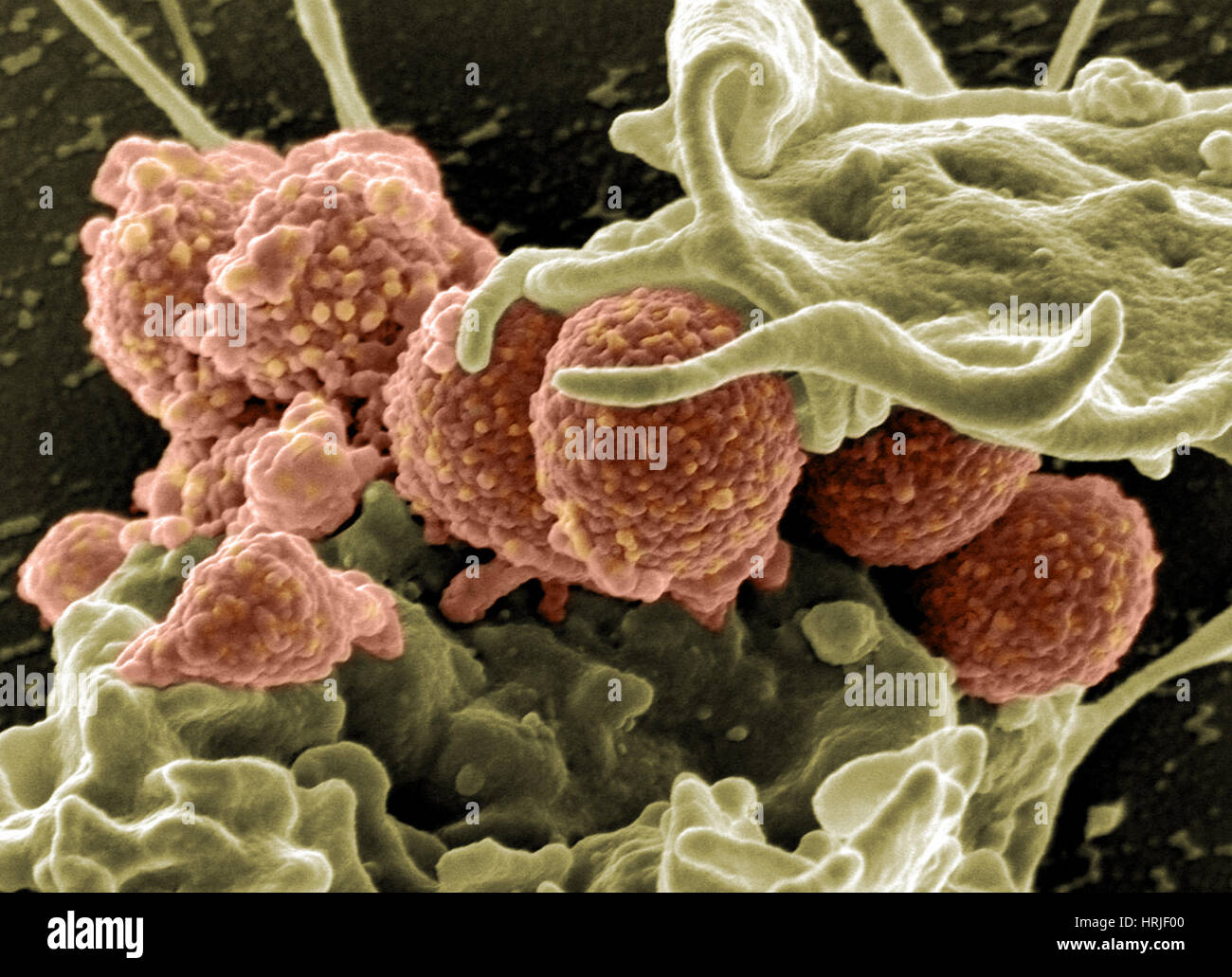 Staphylococcus aureus Bacteria, MRSA, SEM Stock Photo - Alamy Staphylococcus aureus Bacteria, MRSA, SEM Stock Photo - Alamy