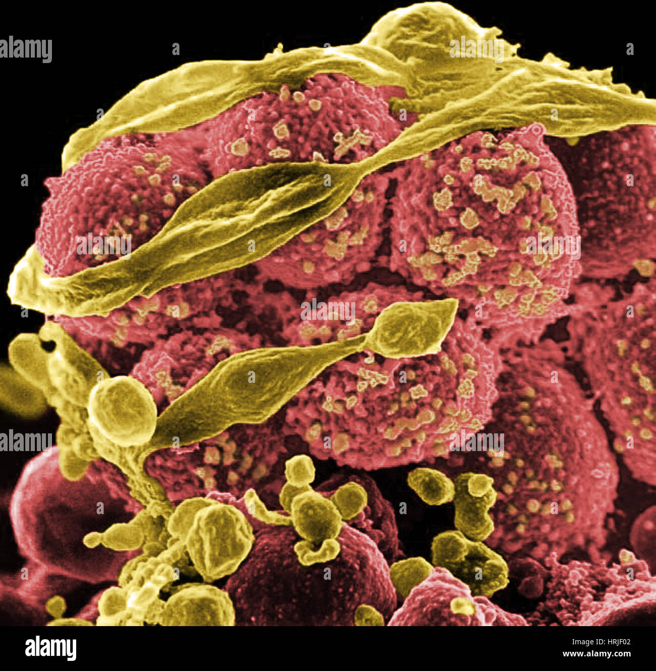 Staphylococcus aureus Bacteria, MRSA, SEM Stock Photo - Alamy Staphylococcus aureus Bacteria, MRSA, SEM Stock Photo - Alamy