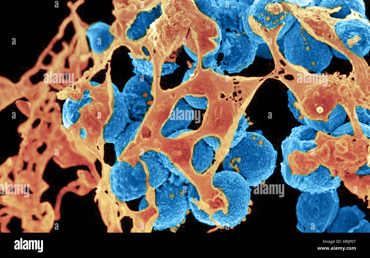 Staphylococcus aureus Bacteria, MRSA, SEM Stock Photo - Alamy Staphylococcus aureus Bacteria, MRSA, SEM Stock Photo - Alamy