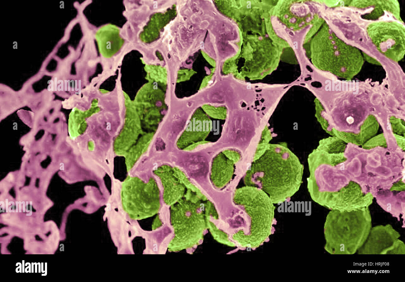 Staphylococcus aureus Bacteria, MRSA, SEM Stock Photo - Alamy Staphylococcus aureus Bacteria, MRSA, SEM Stock Photo - Alamy