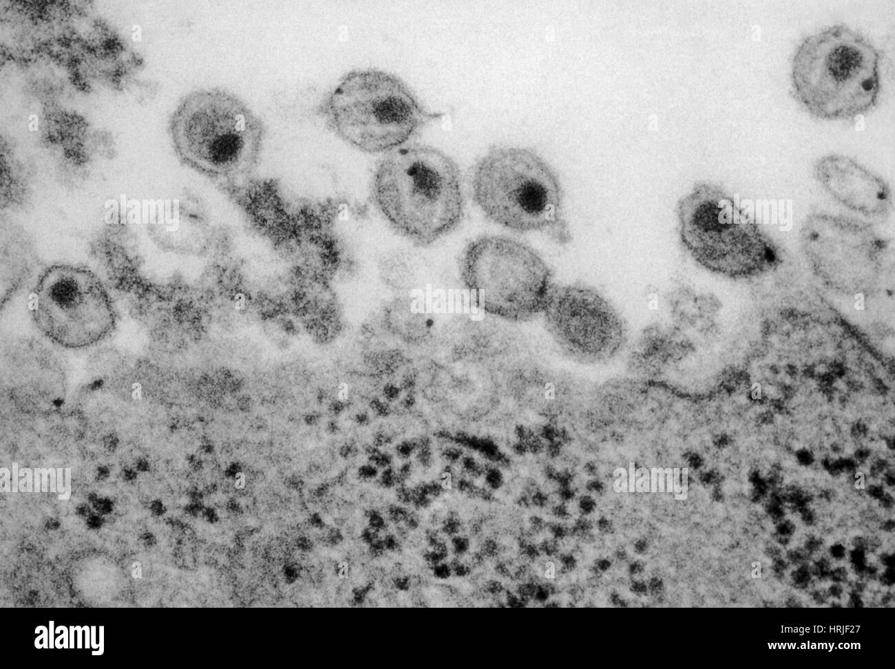 AIDS Virus, TEM Stock Photo - Alamy