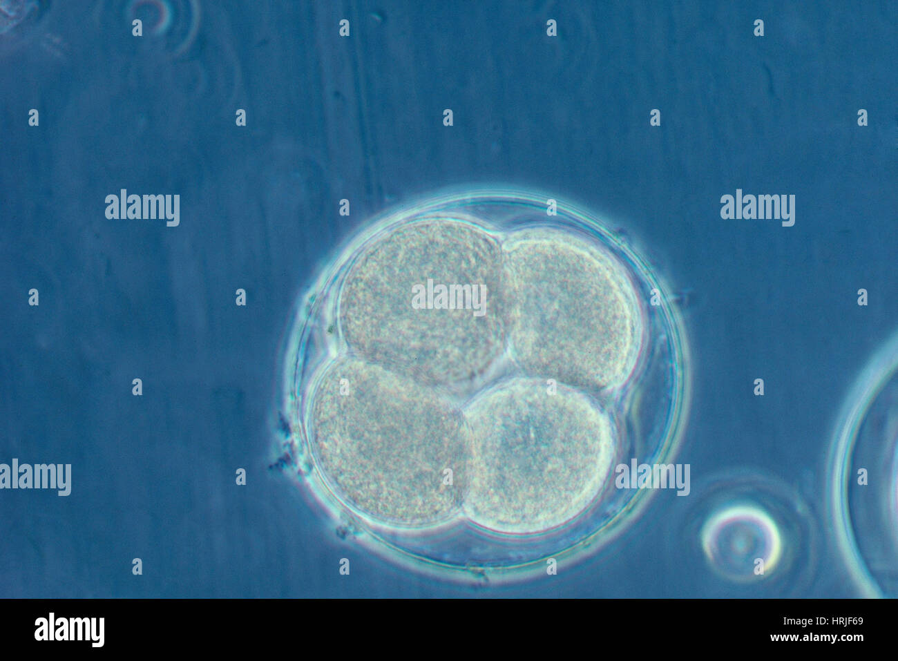 Embryo development urchin hi-res stock photography and images - Alamy