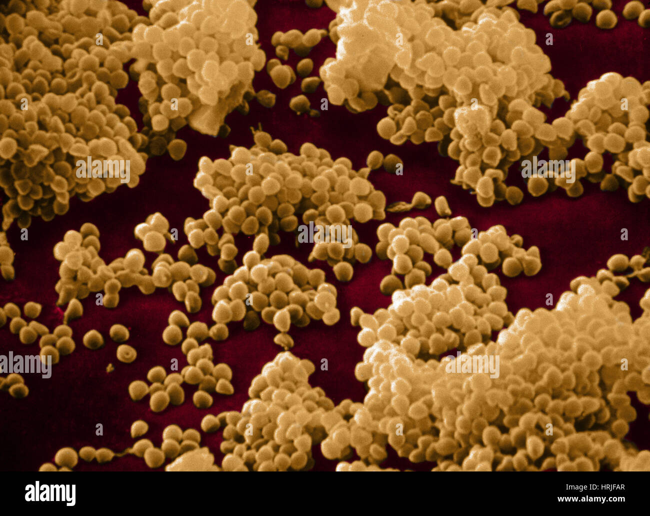 Micrococcus Agilis, SEM Stock Photo - Alamy
