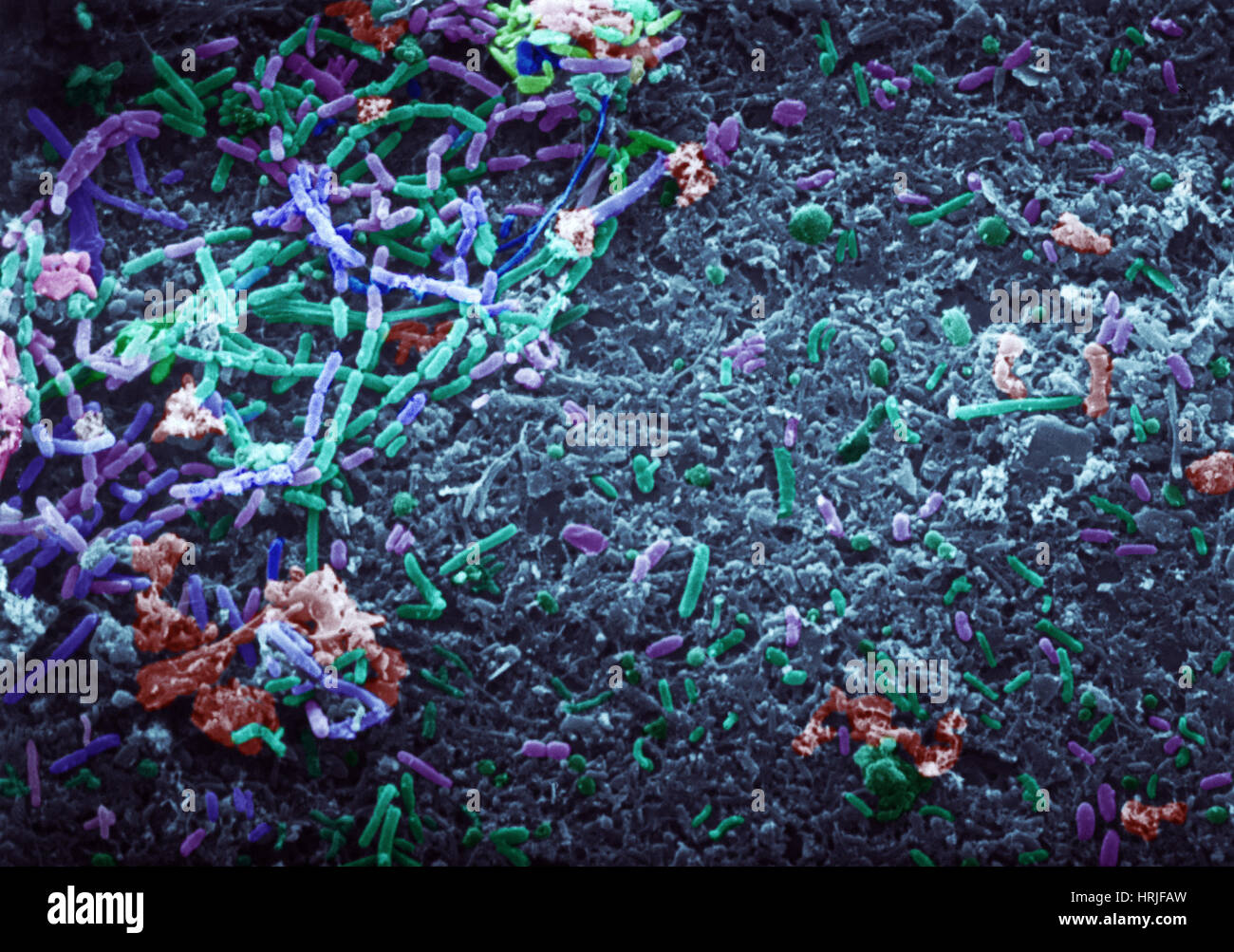 Bacteria in Raw Sewage (SEM Stock Photo - Alamy