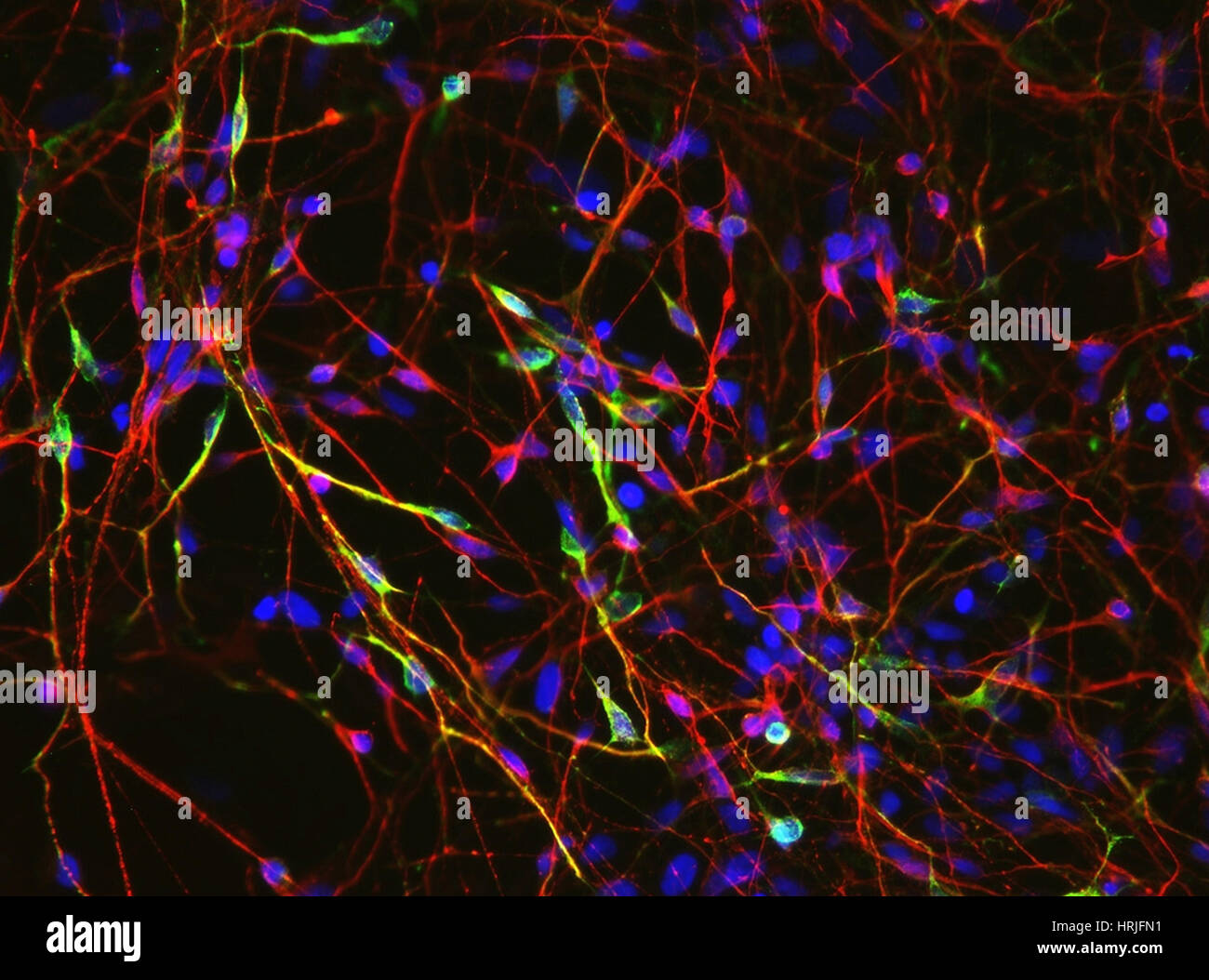 Micrograph of human nerve cell hi-res stock photography and images - Alamy