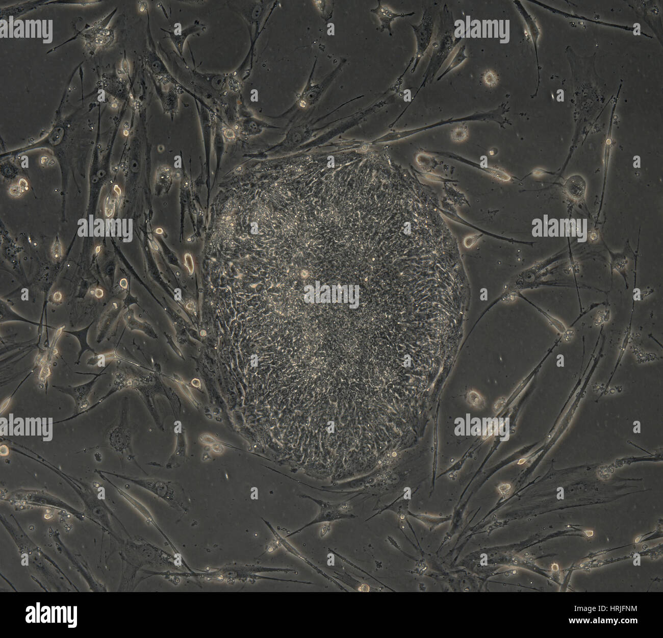 Induced Pluripotent Stem Cells