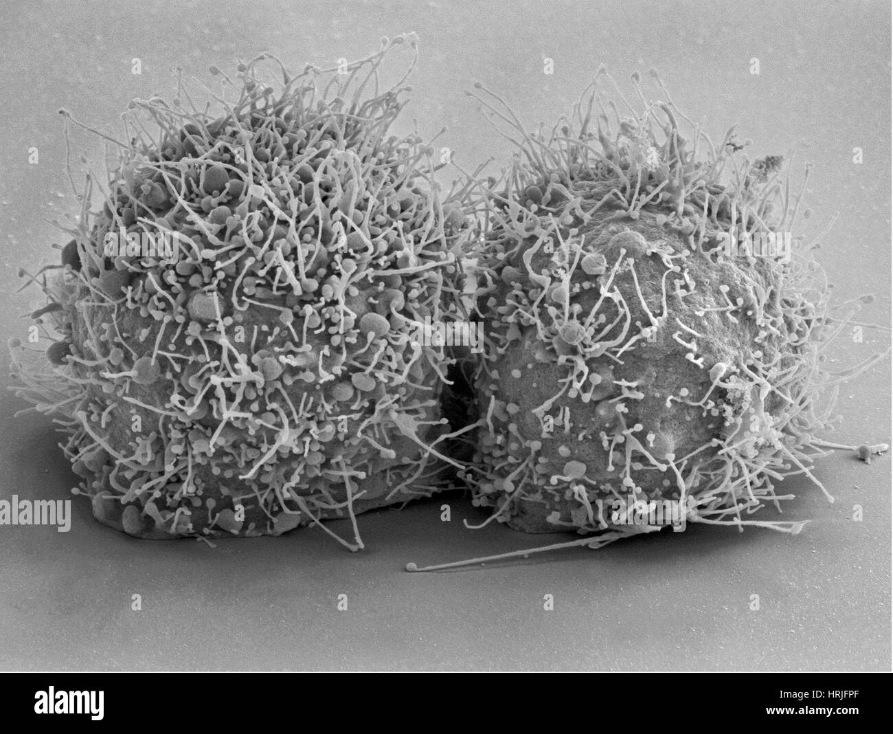 Dividing HeLa Cells, SEM Stock Photo - Alamy
