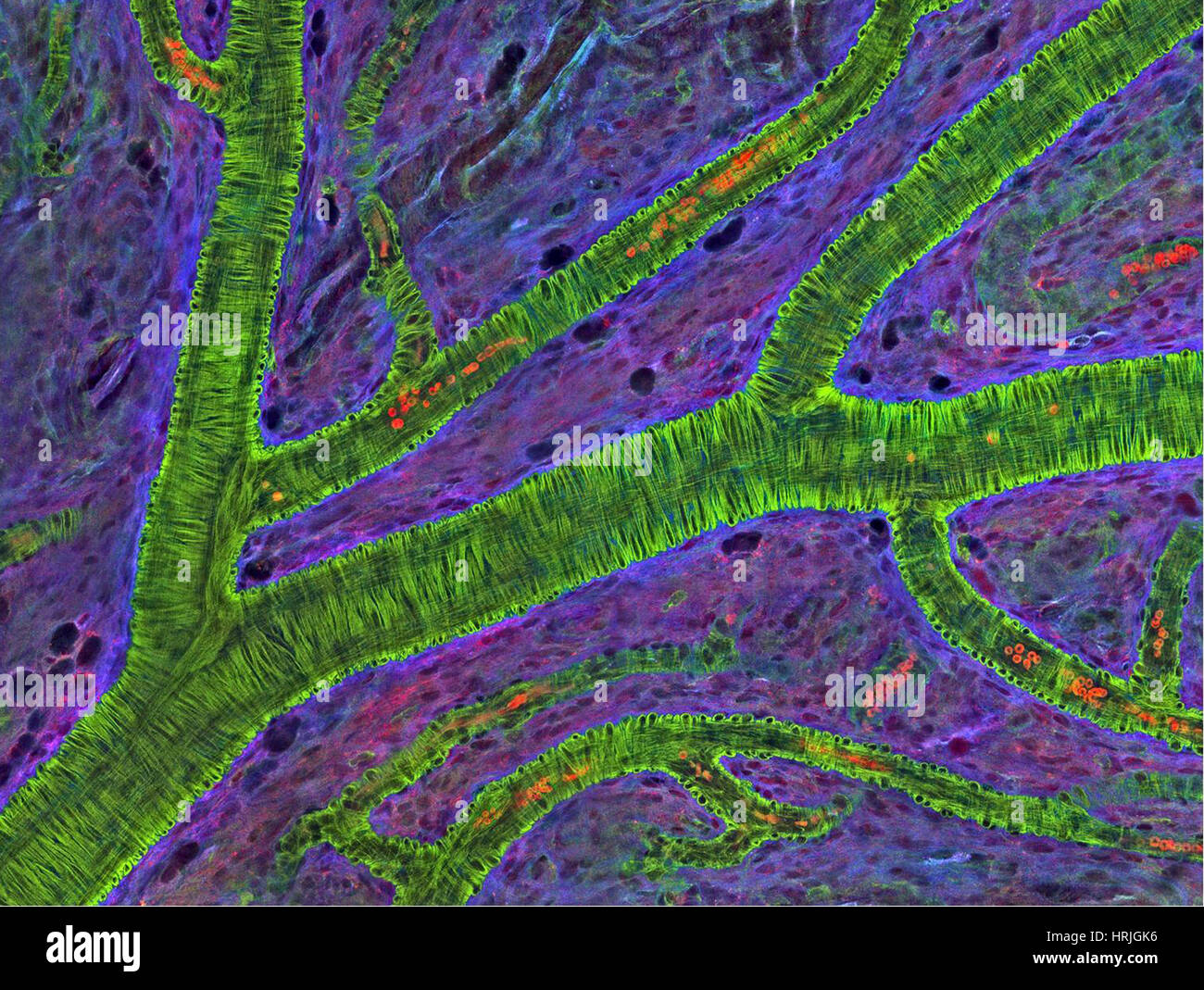 Normal retina hi-res stock photography and images - Alamy
