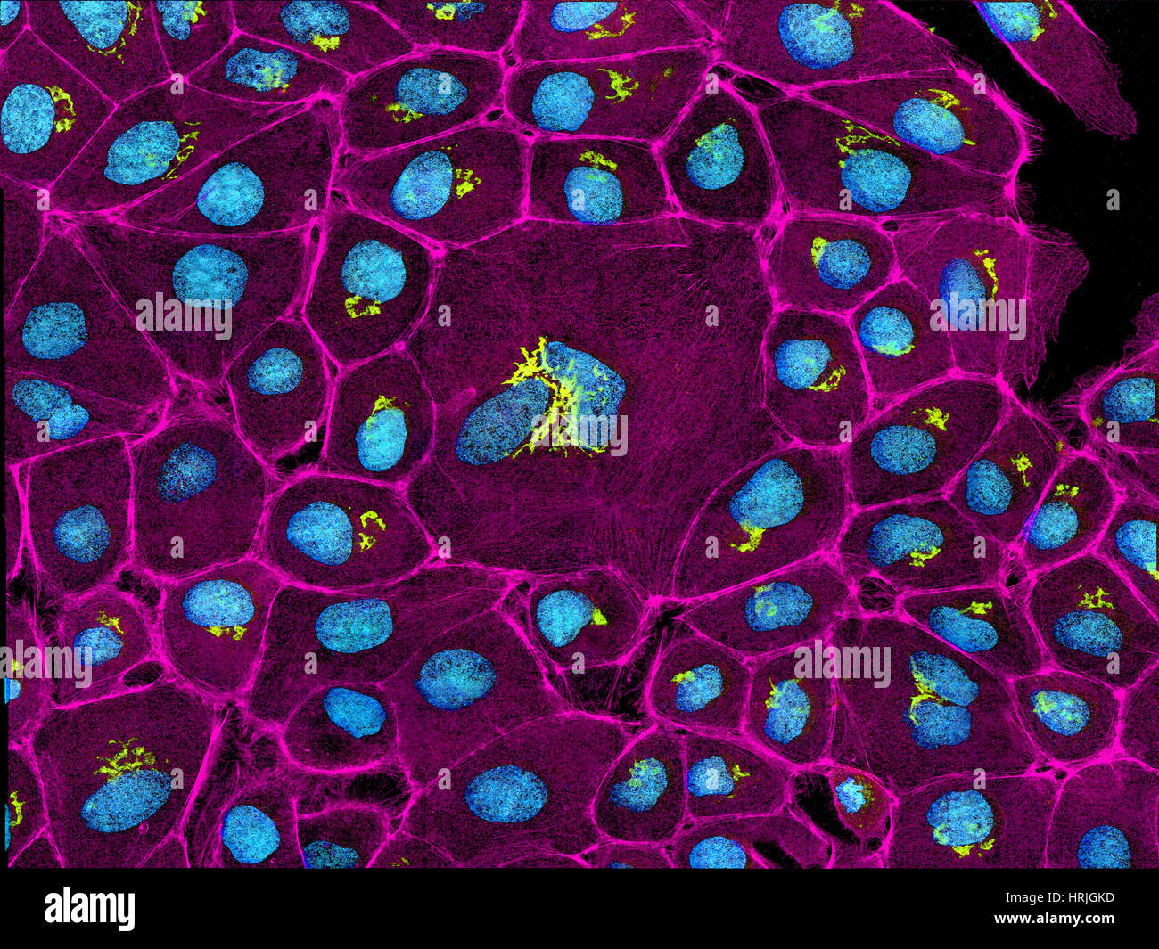 Fluorescent micrograph hi-res stock photography and images - Alamy