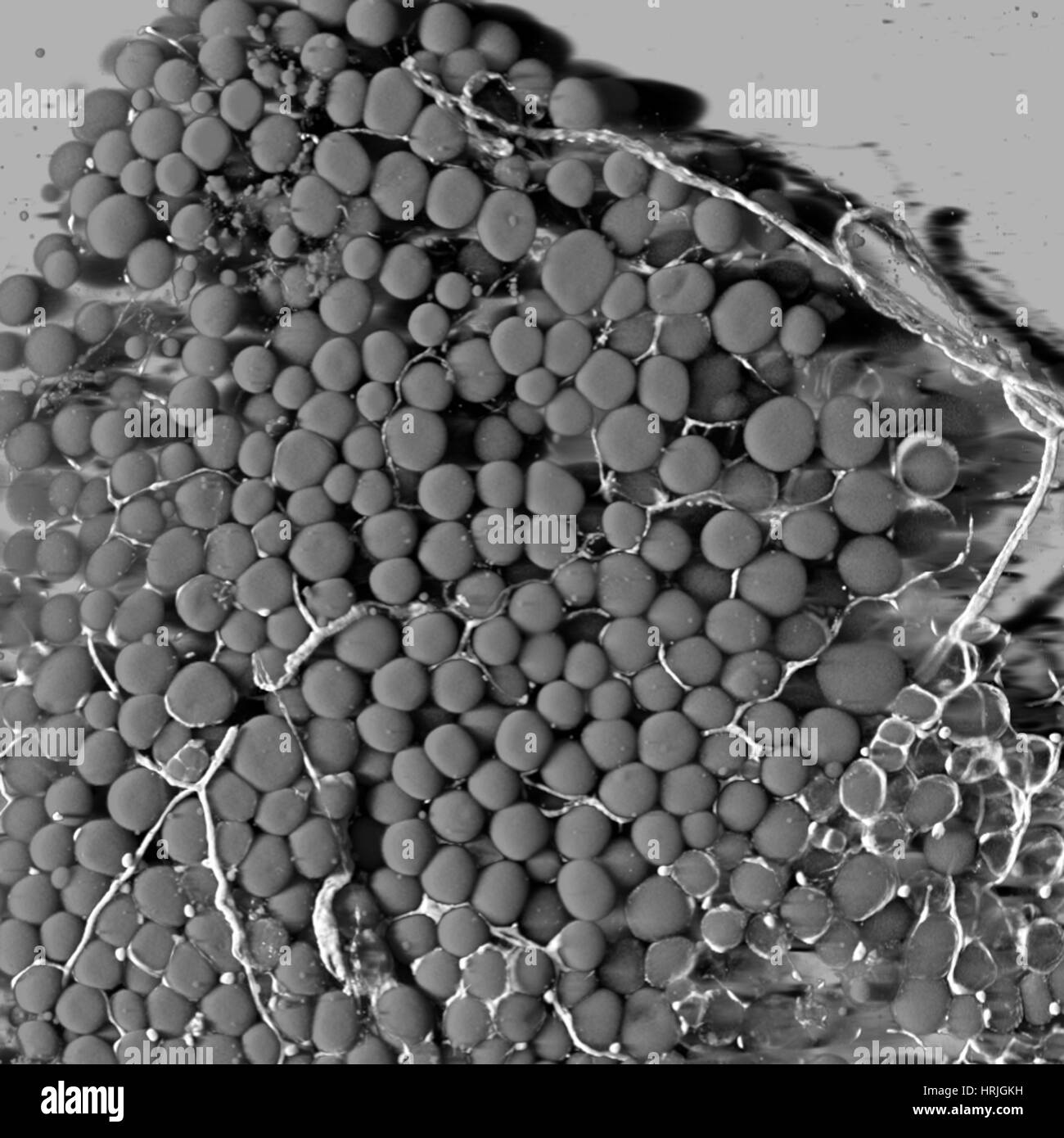 Fat cells micrograph hi-res stock photography and images - Alamy