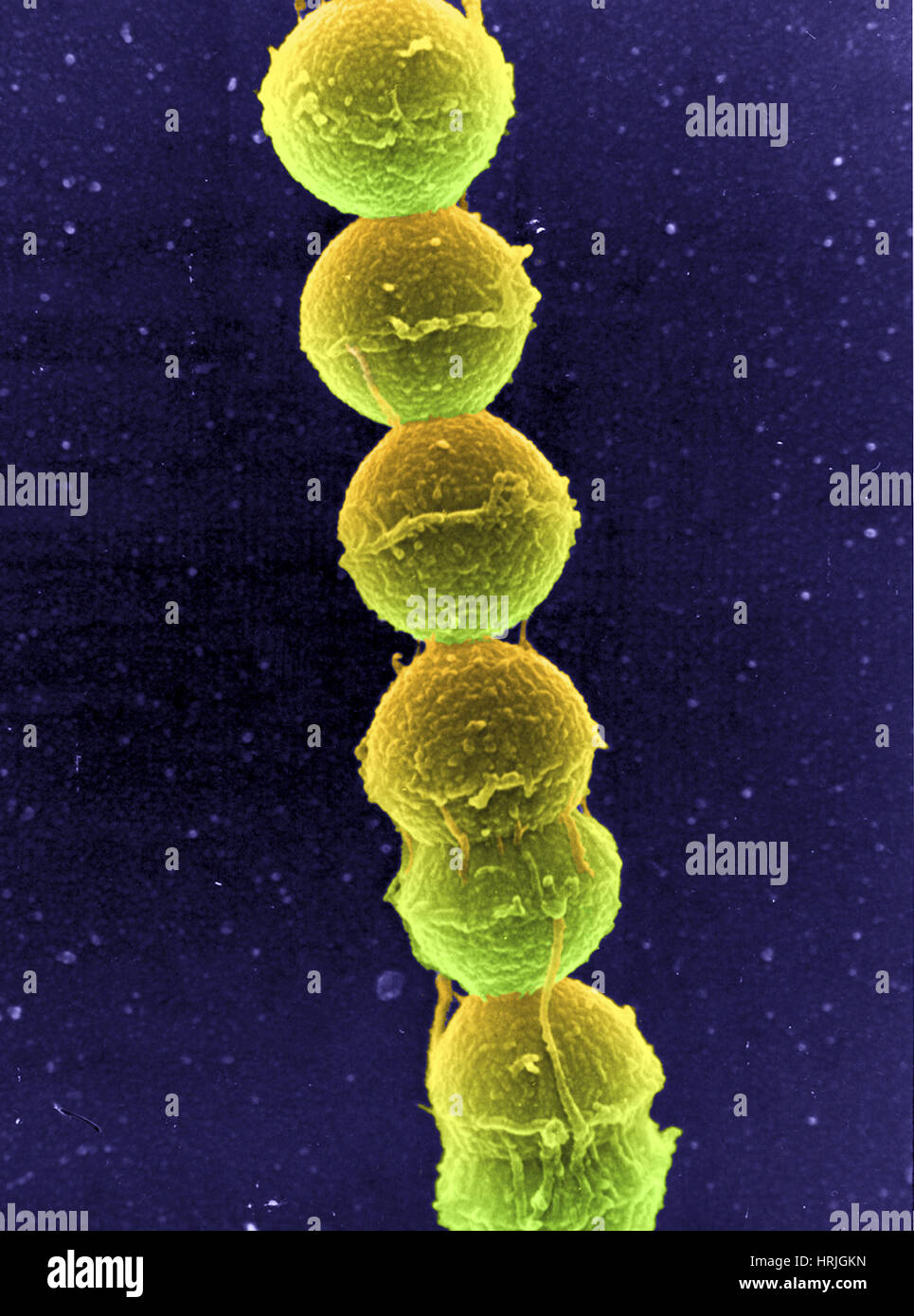 Streptococcus Bacteria Diagram
