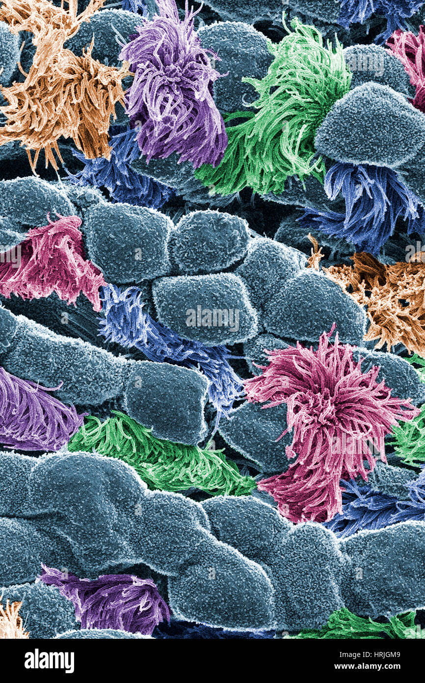 Epithelial cells hi-res stock photography and images - Alamy
