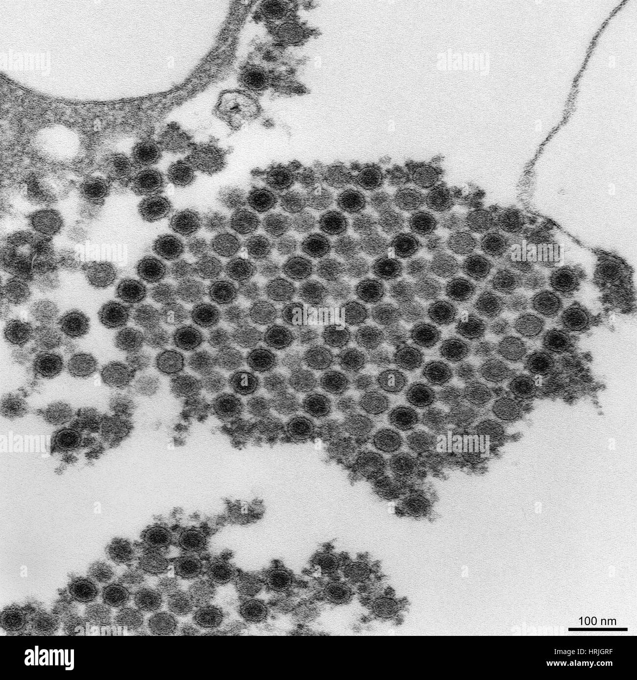 Chikungunya Black and White Stock Photos & Images - Alamy