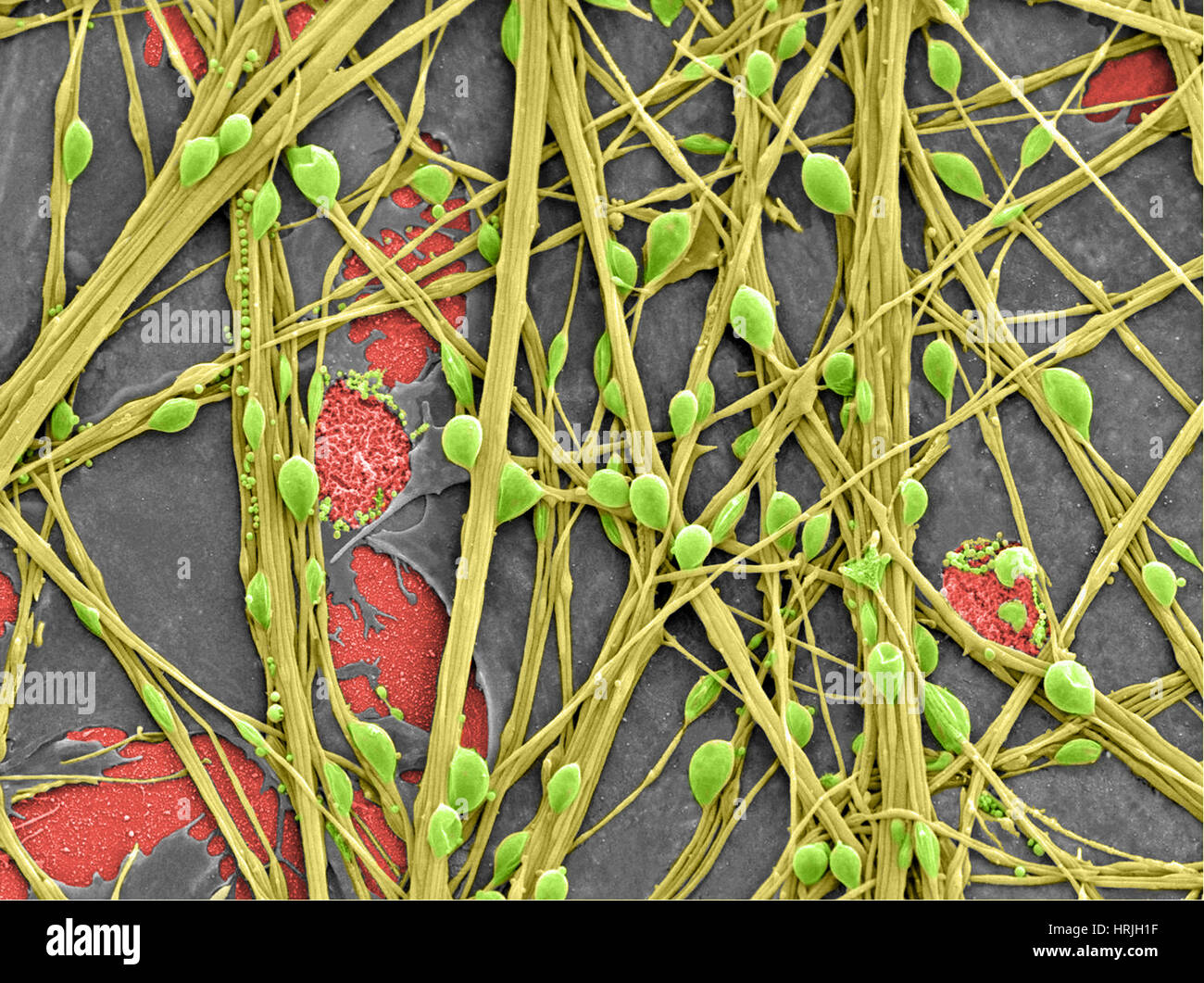 Electron micrograph neuron hi-res stock photography and images - Alamy