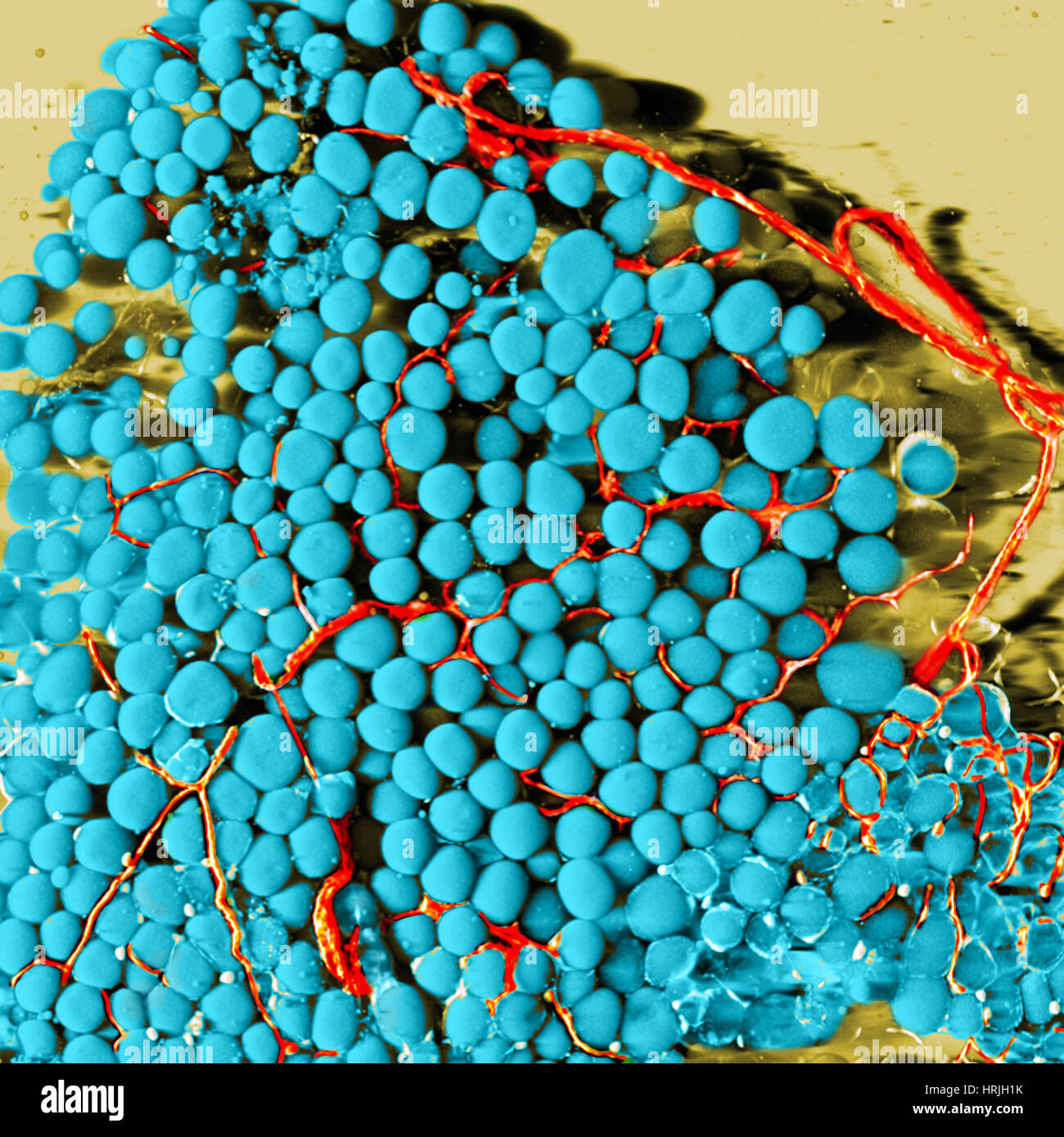 Fat cells micrograph hi-res stock photography and images - Alamy