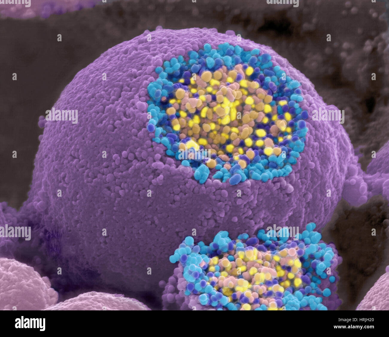 Scanning electron micrograph neuron hi-res stock photography and images ...