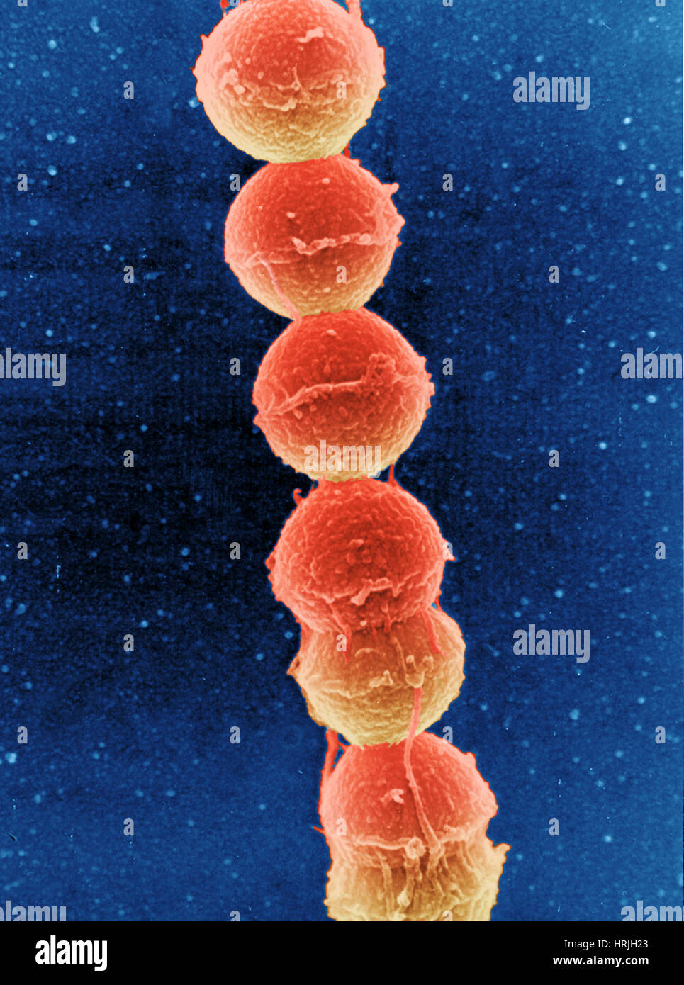 Streptococcal bacteria hi-res stock photography and images - Alamy