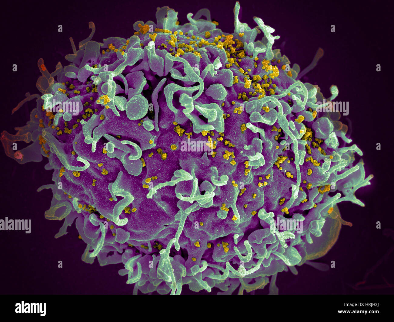HIV, T Cell Under Attack, SEM Stock Photo - Alamy