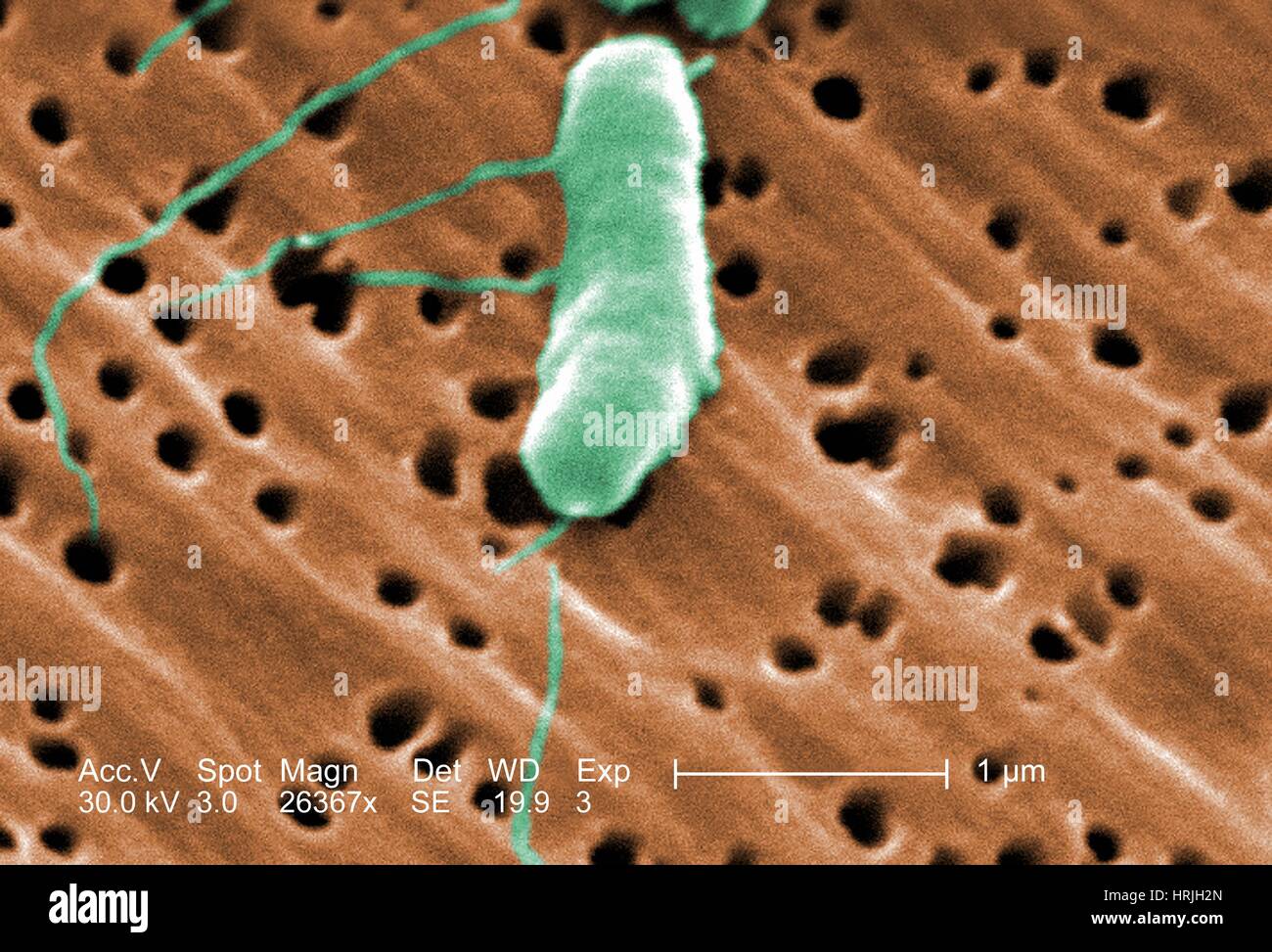 Vibrio vulnificus, SEM Stock Photo - Alamy