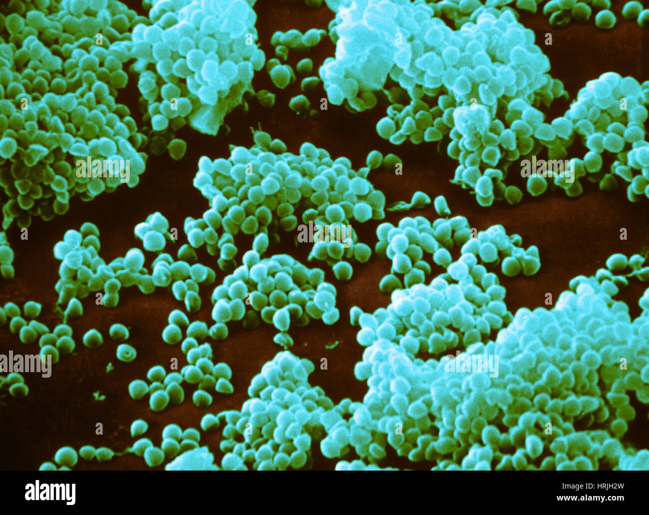 Coccus micrograph hi-res stock photography and images - Alamy
