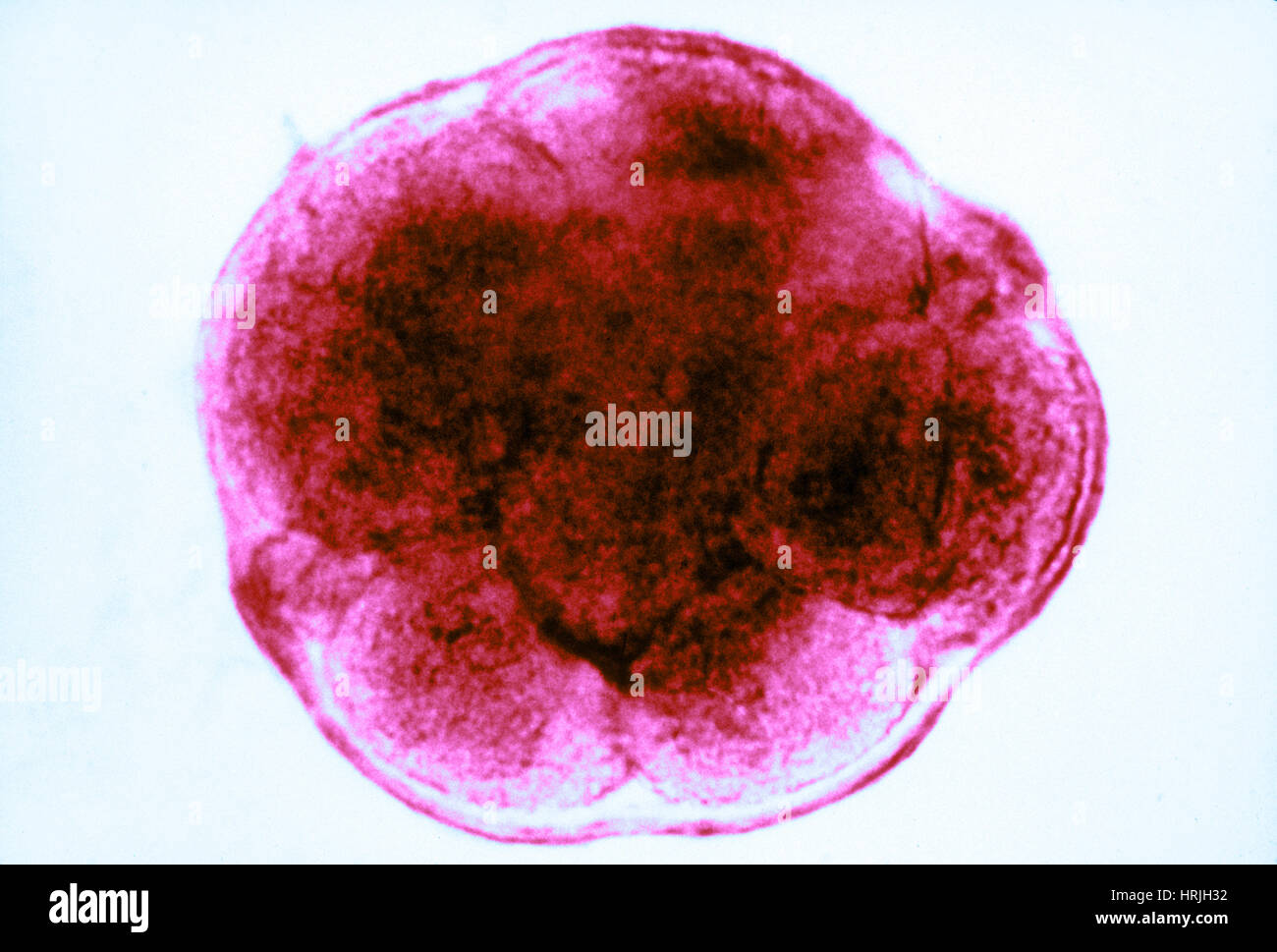 Human Ovum, LM Stock Photo - Alamy