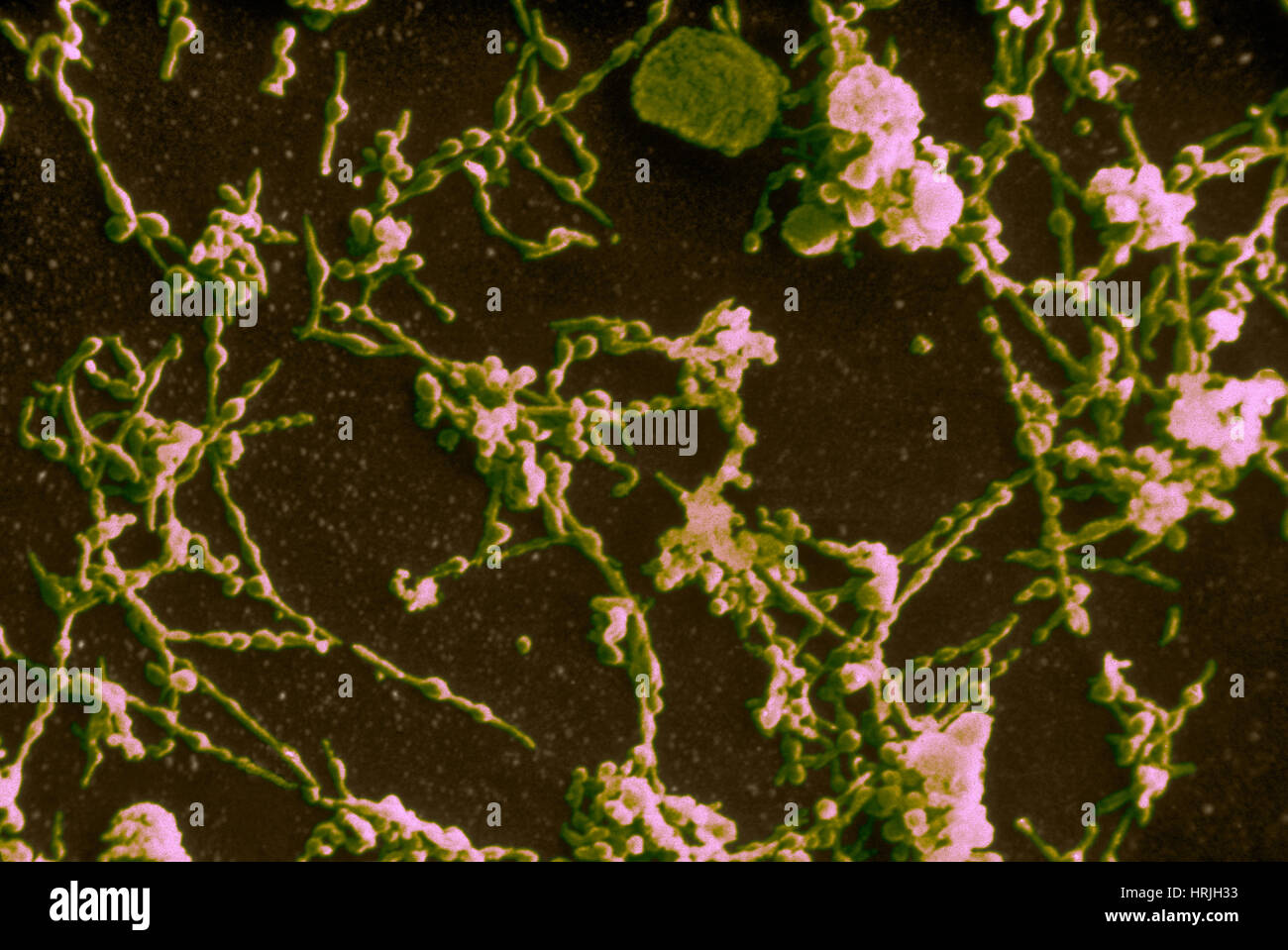 Mycoplasma pneumoniae hi-res stock photography and images - Alamy