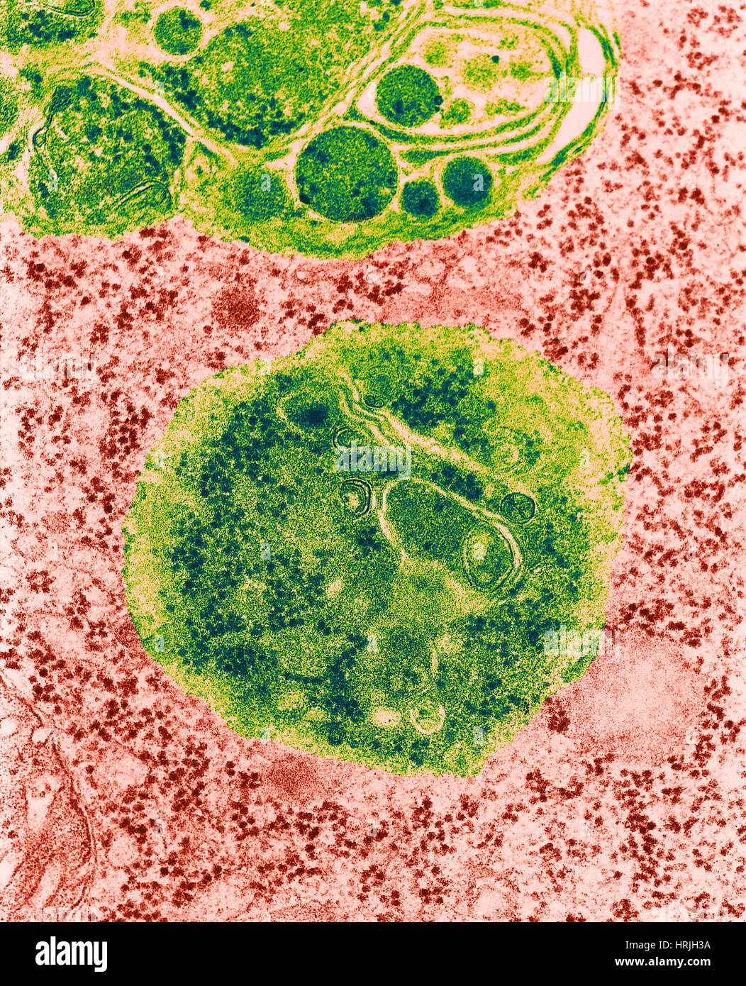 Lysosome micrograph hi-res stock photography and images - Alamy Lysosome micrograph hi-res stock photography and images - Alamy