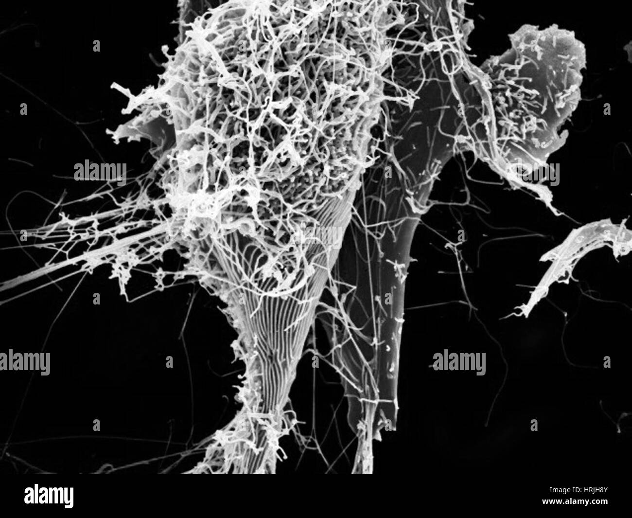 Ebola Virus Particles, SEM Stock Photo - Alamy
