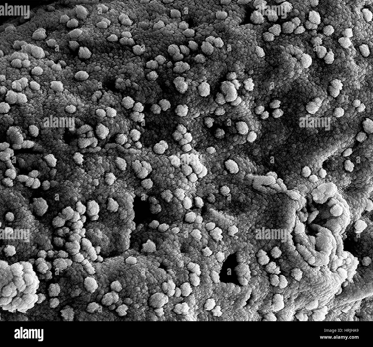 MERS Coronavirus Particles, SEM Stock Photo - Alamy