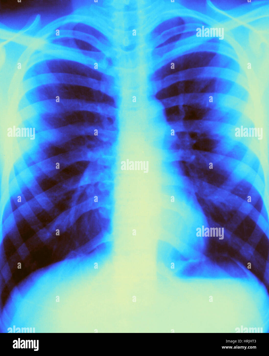 Circulatory system heart lungs hi-res stock photography and images - Alamy