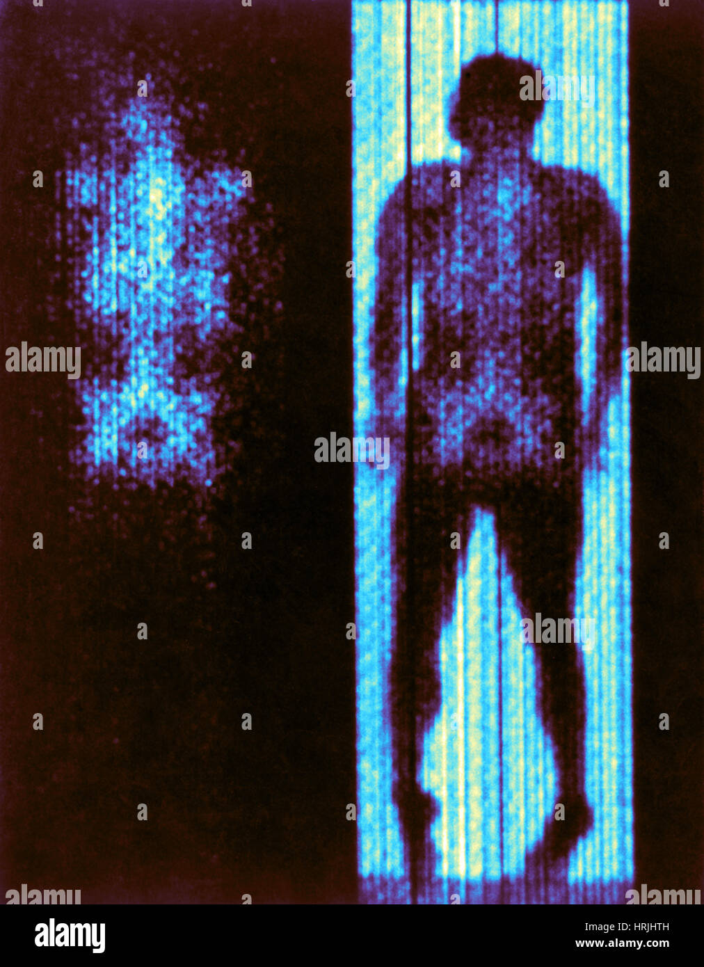 Distribution of Red-Cell-Forming Tissue Stock Photo - Alamy