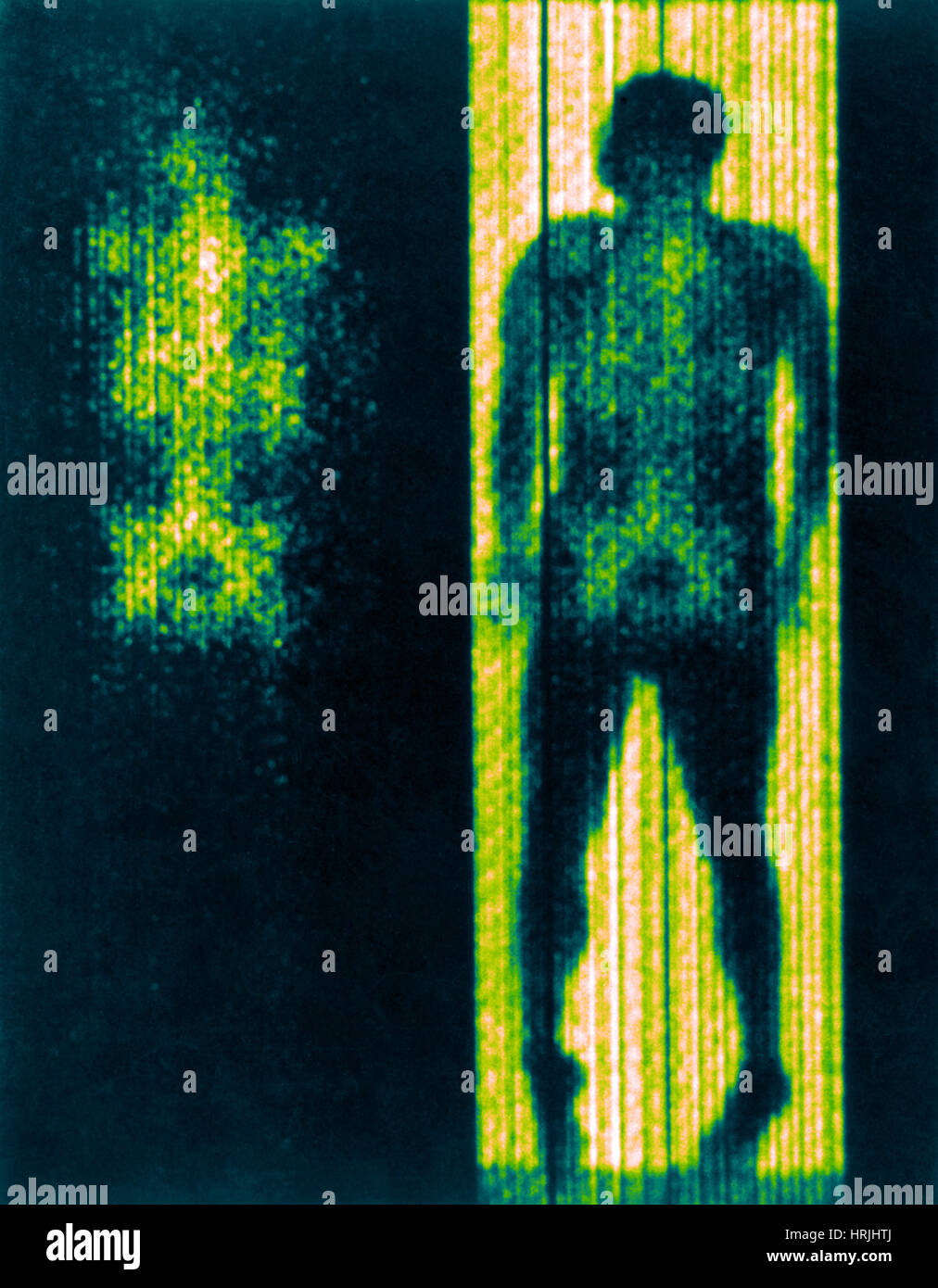 Distribution of Red-Cell-Forming Tissue Stock Photo - Alamy