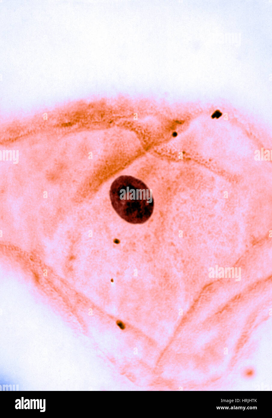 Squamous epithelium micrograph hi-res stock photography and images - Alamy