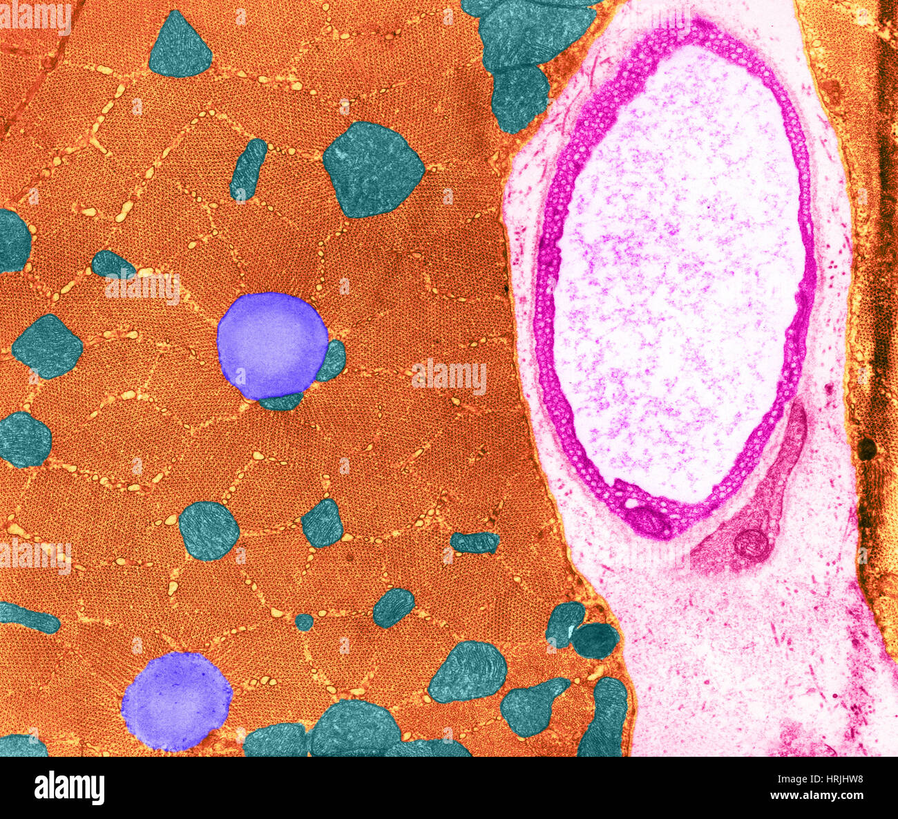 The muscle fiber and the myofibril hi-res stock photography and images ...