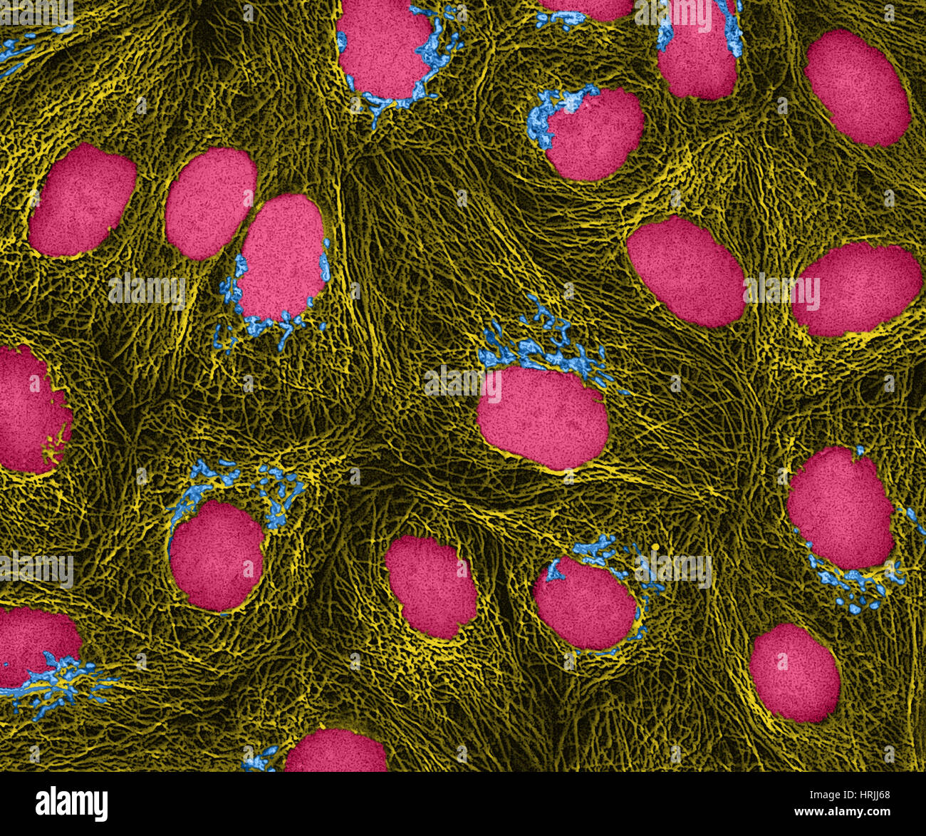 HeLa Cells, MFM Stock Photo - Alamy
