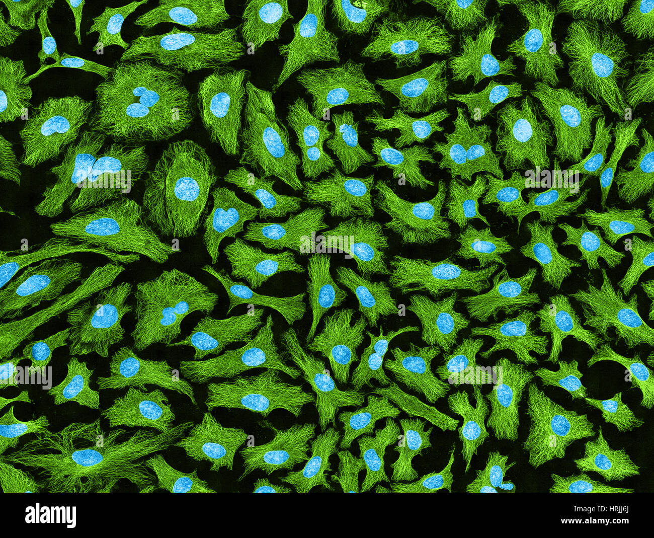 Hela cells hi-res stock photography and images - Alamy