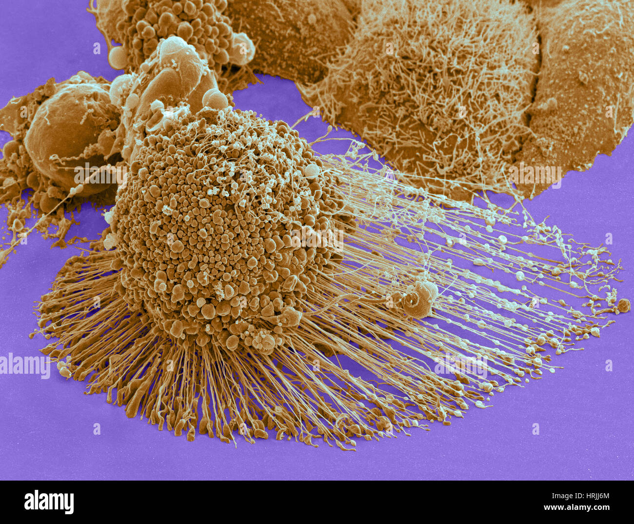 Apoptotic HeLa Cell, SEM Stock Photo - Alamy