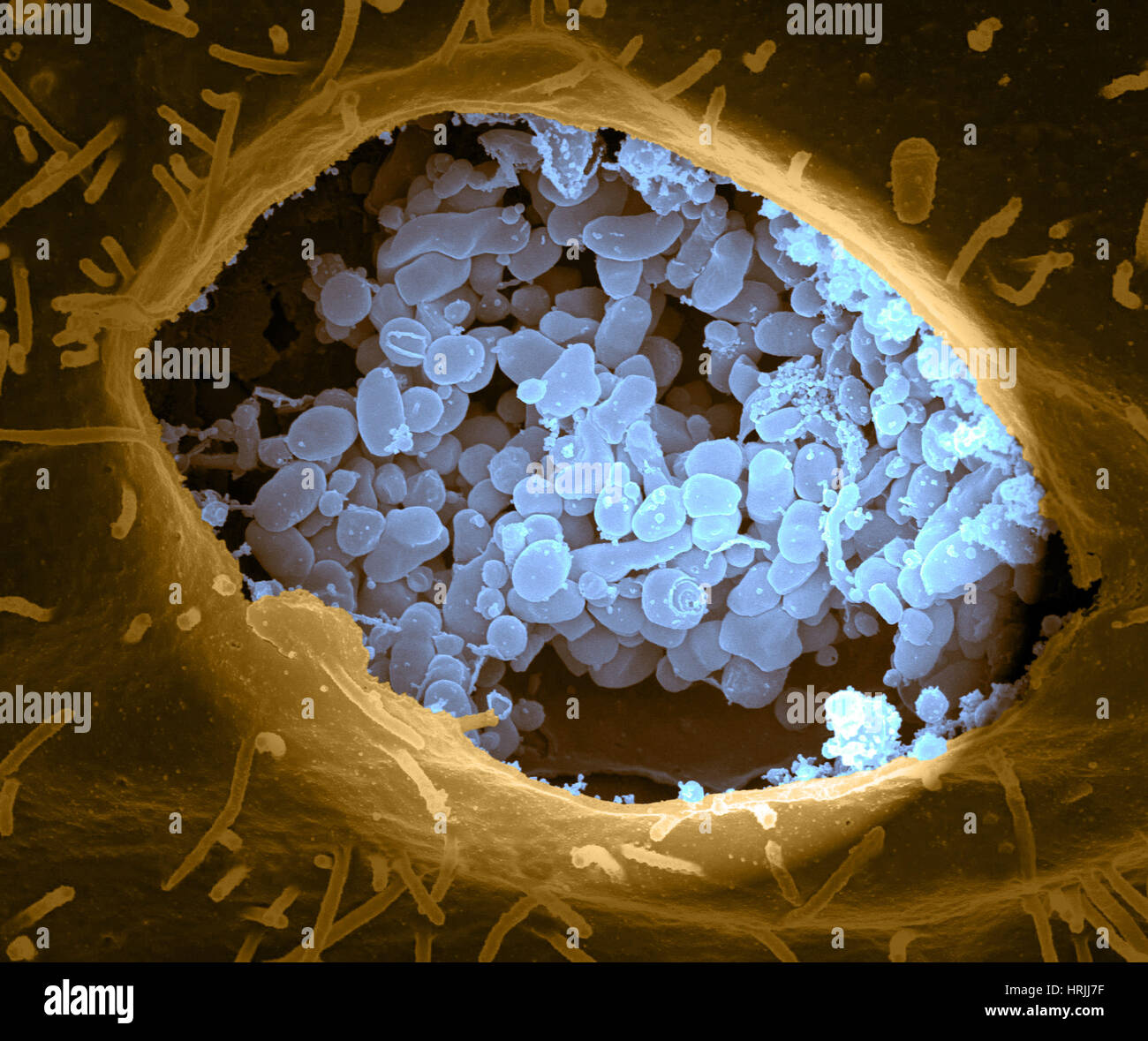 Coxiella burnetii Bacteria, SEM Stock Photo: 135019123 - Alamy